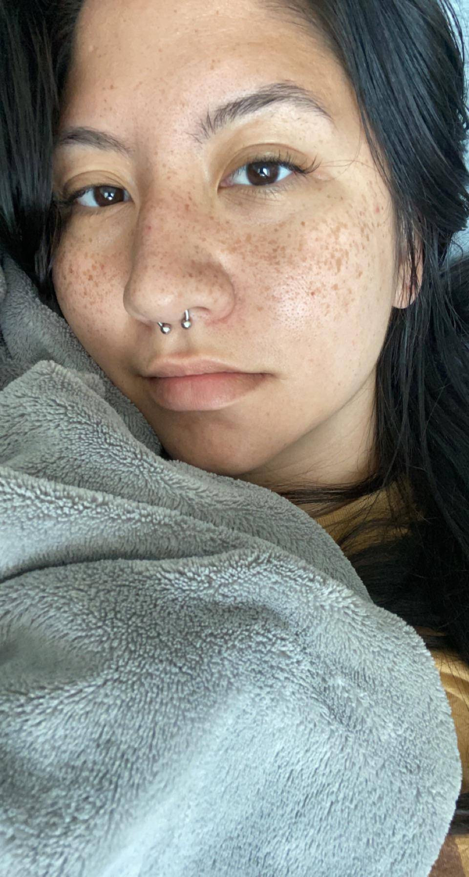 NB25 no filters, no makeup, just freckles | Scrolller