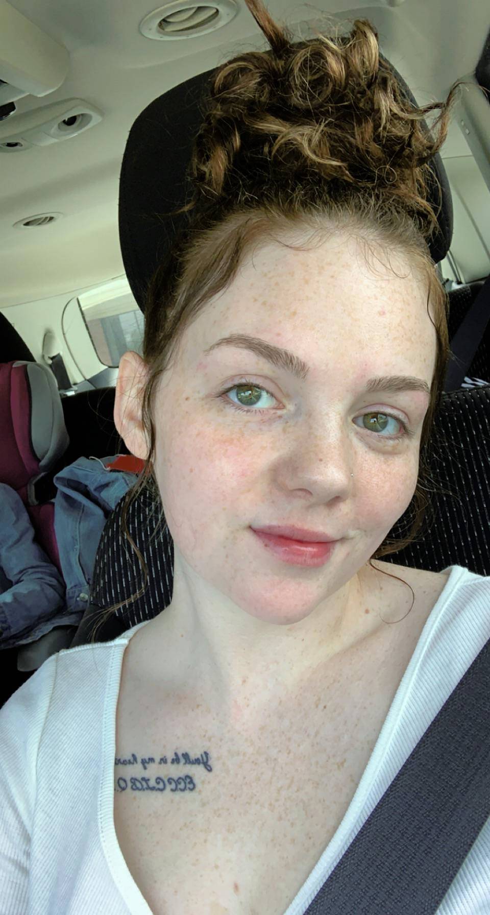 Nice day to have the freckles out 🌞 | Scrolller