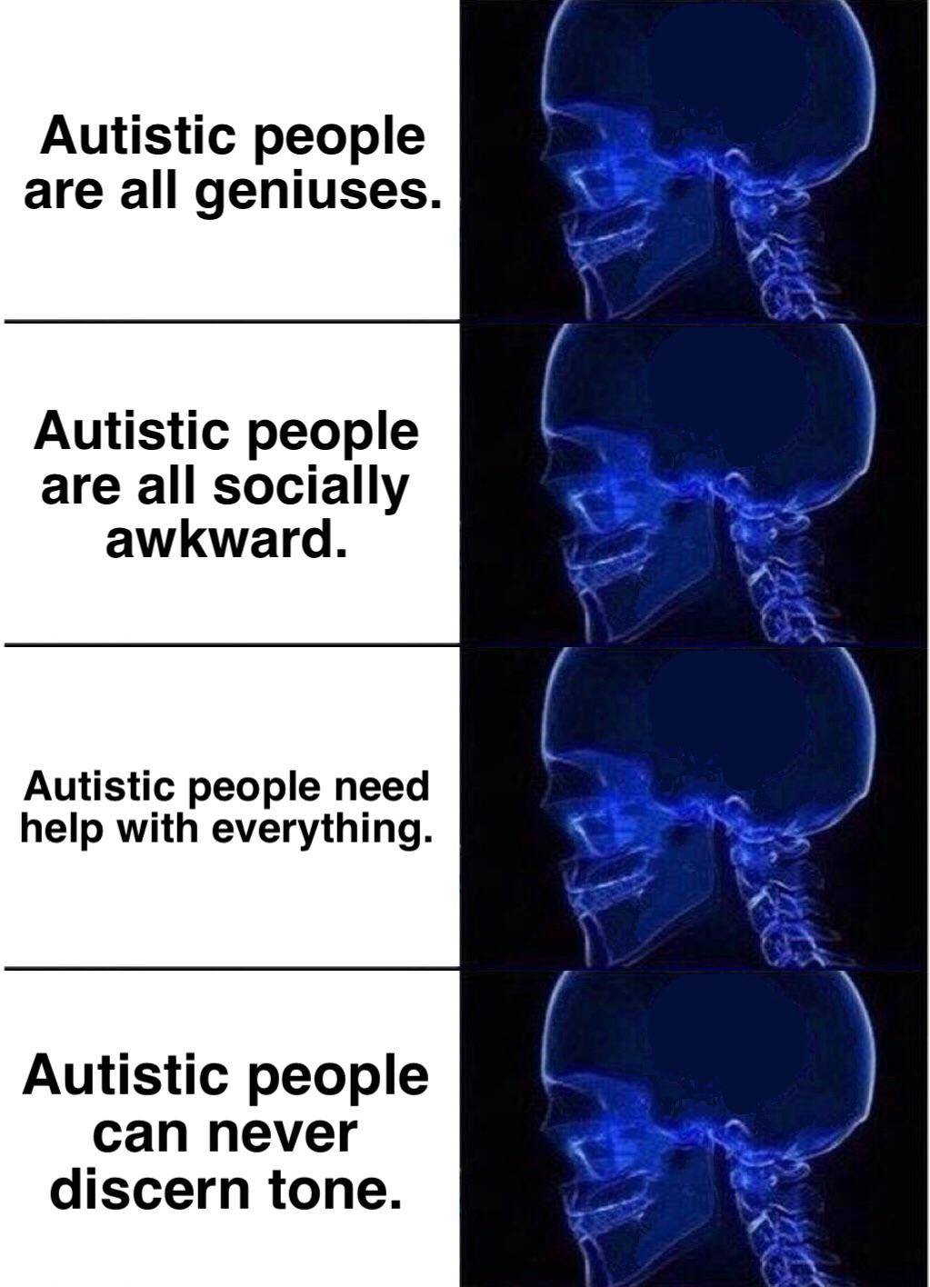 No Brain Template | Scrolller