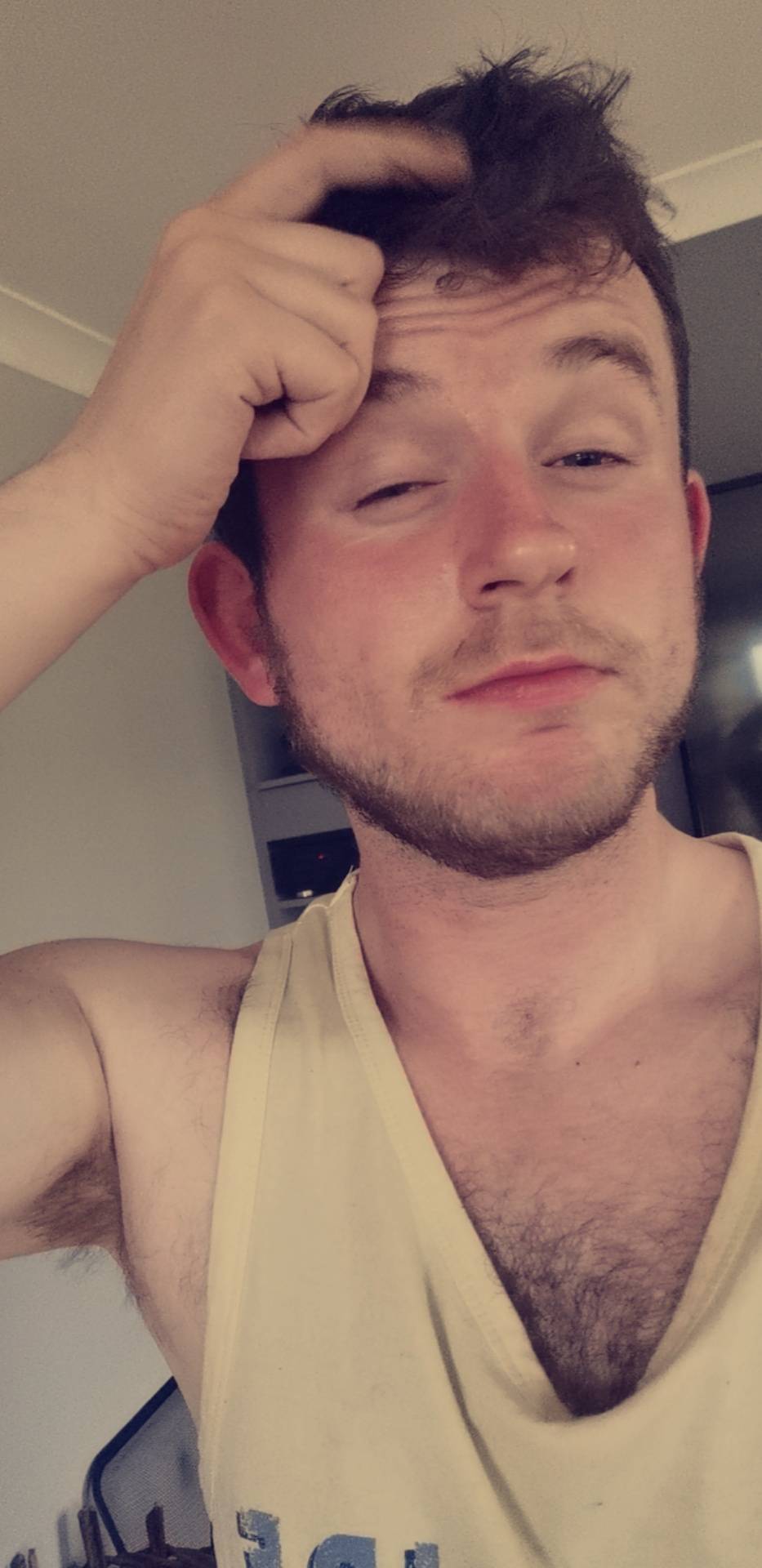 Not coping with this sunburn. | Scrolller