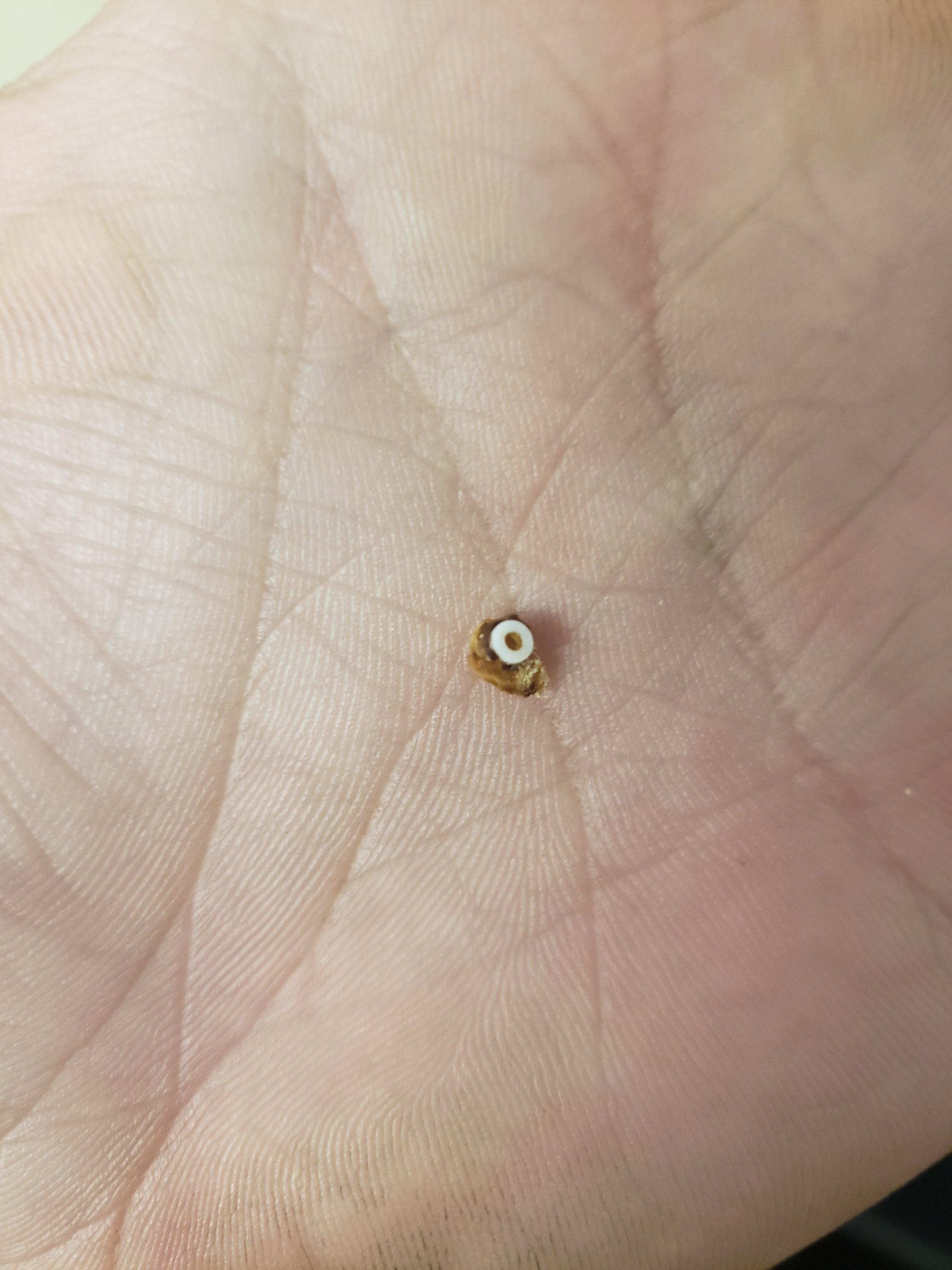 [NSFW-ish] I think this just fell out of my ear. Is it my tube? | Scrolller