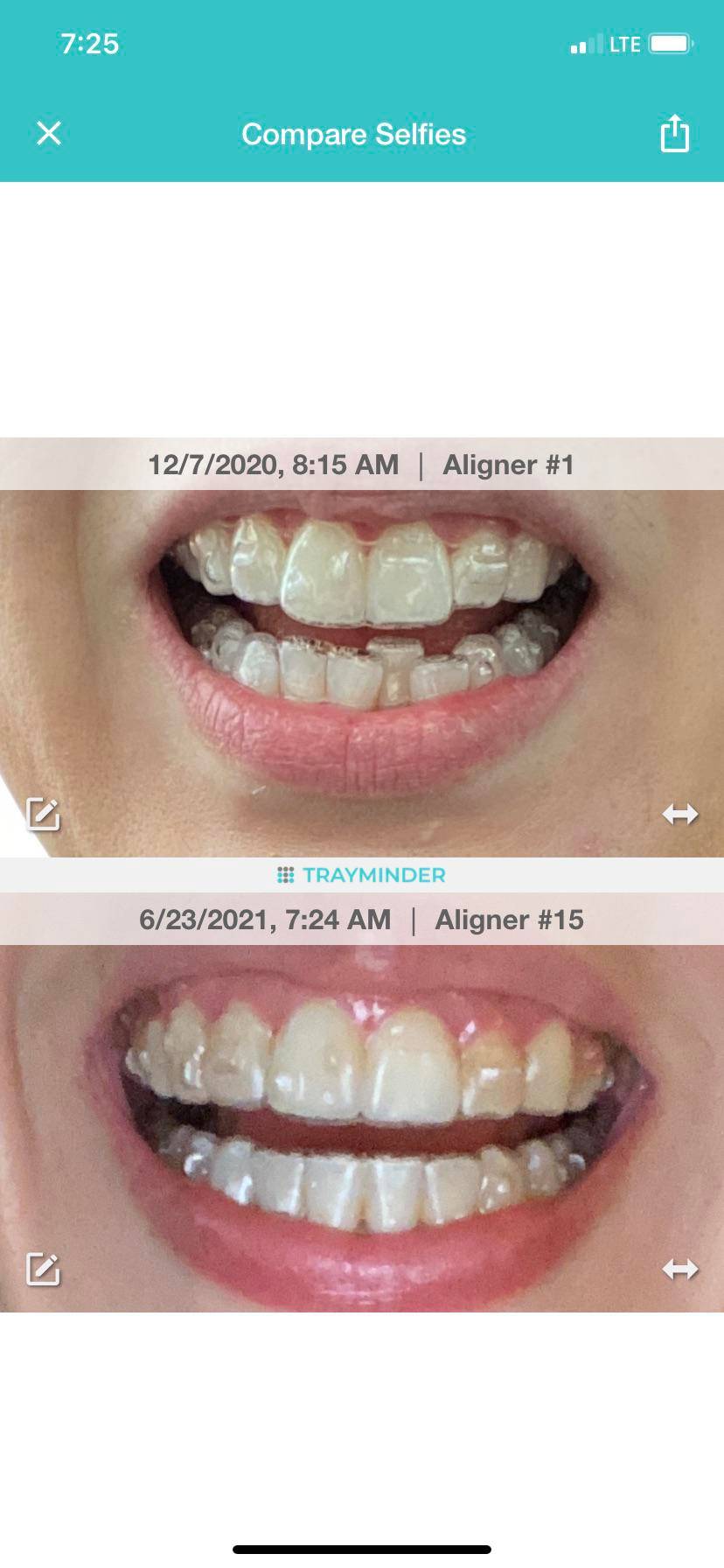 Obligatory before & after | Scrolller