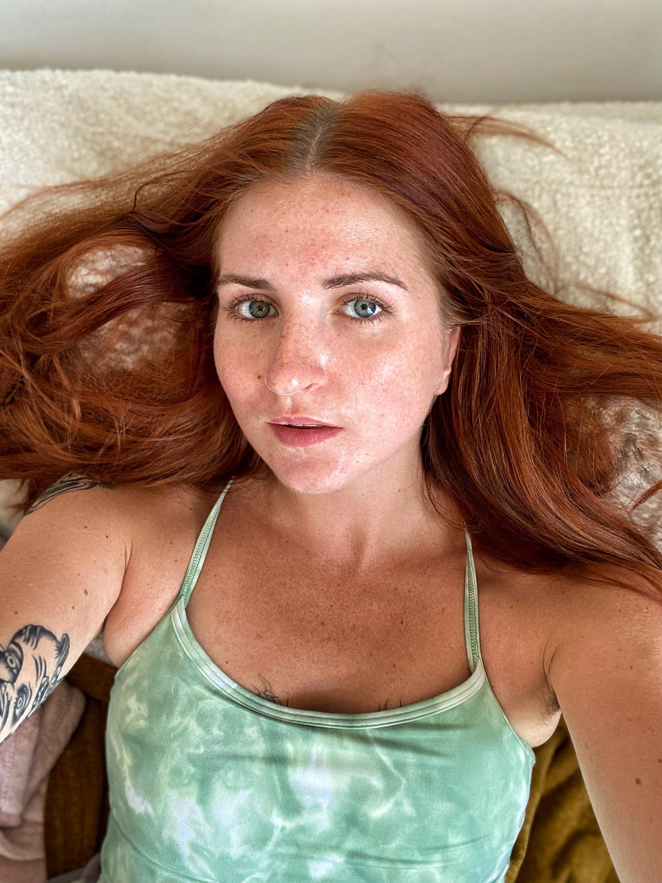 Obsessed with freckles hen 😇 | Scrolller