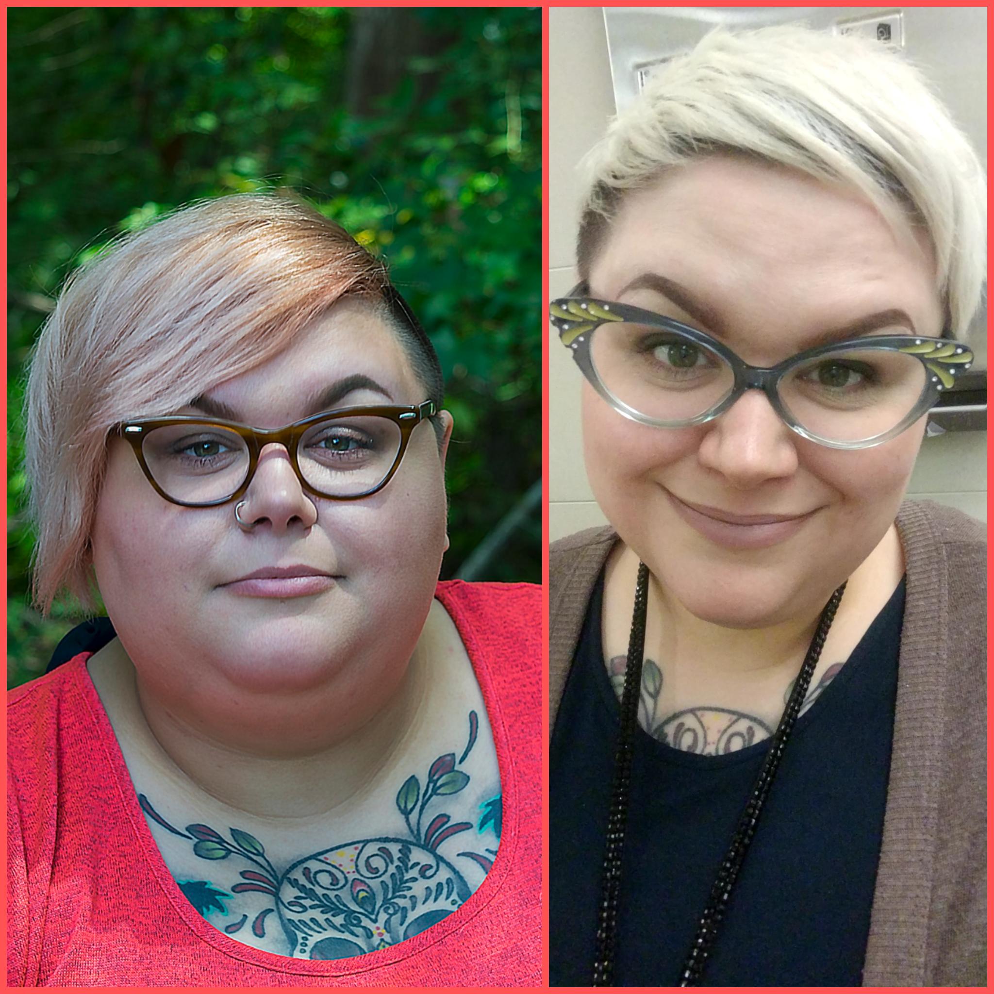 One year sleeve anniversary was a month ago. I'm down 108 lbs. I don't ...
