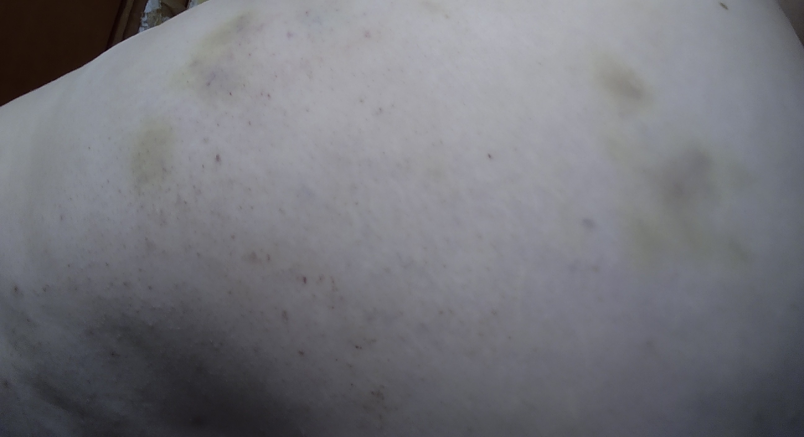 Only a little bruised this time | Scrolller