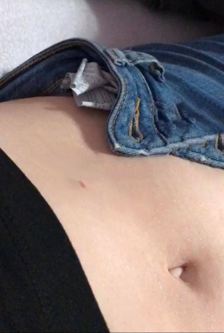 Outie belly button | Scrolller