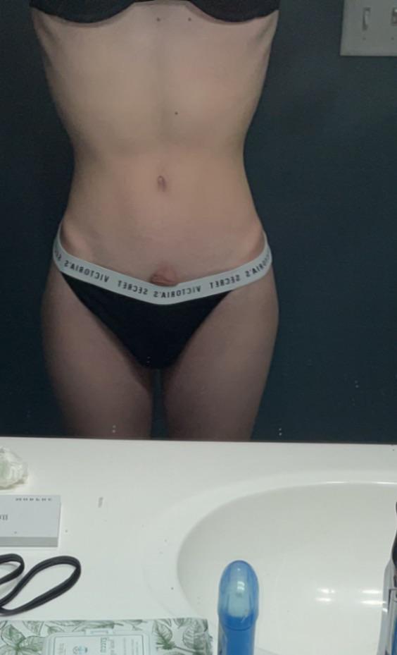 peeking through ☺️ | Scrolller