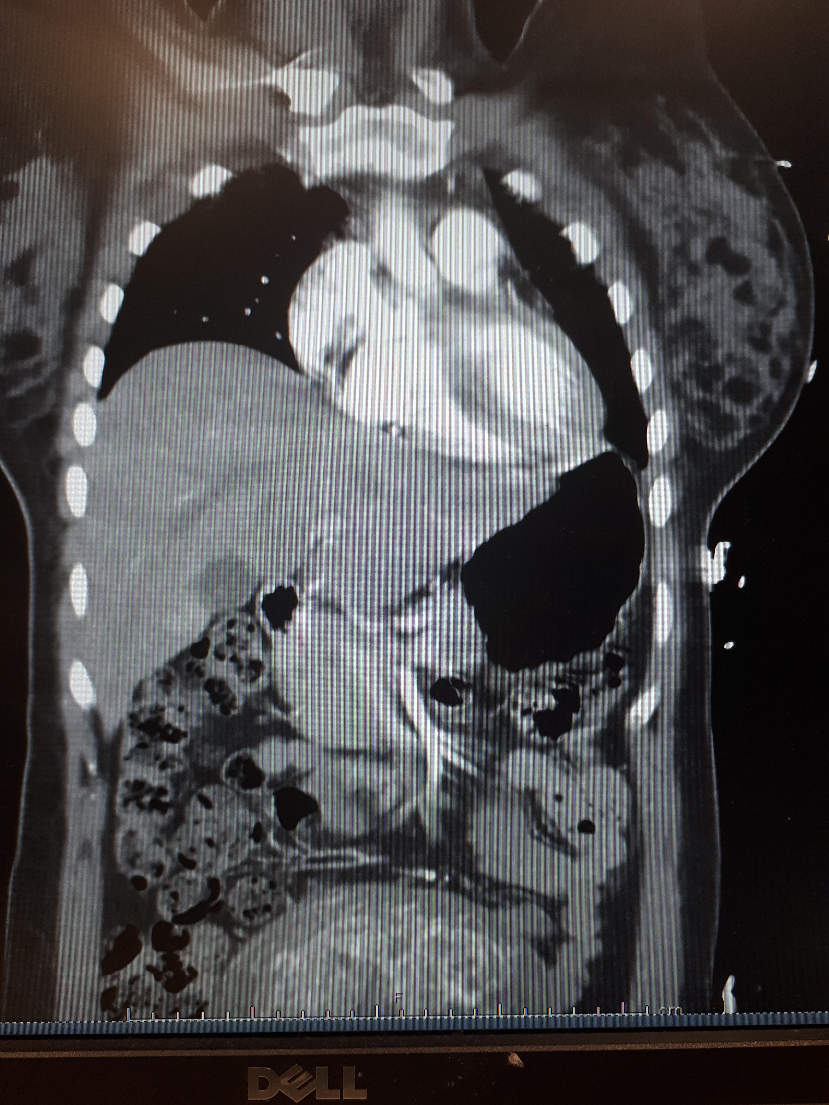 Poop ghost? | Scrolller