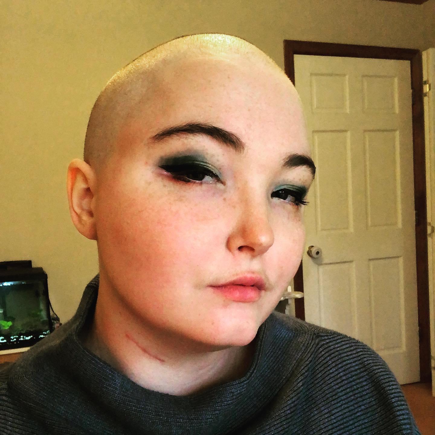 Recently shaved my head due to hair loss from chemo. I both love and hate my bald head 👩‍🦲 ...