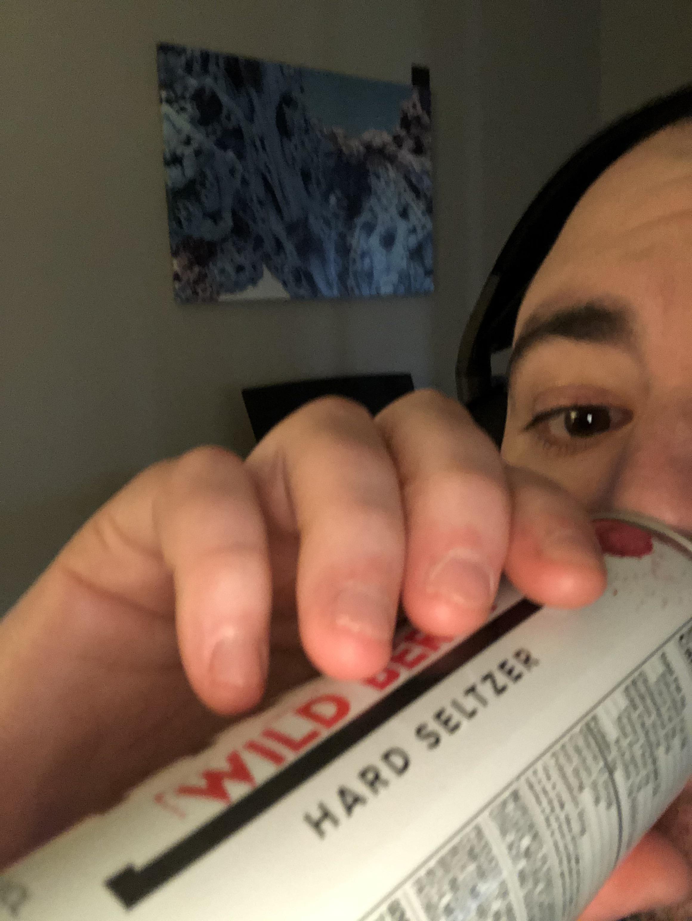 Required | Scrolller