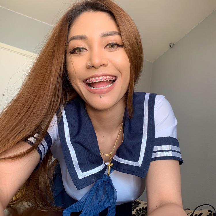 Schoolgirl braces | Scrolller