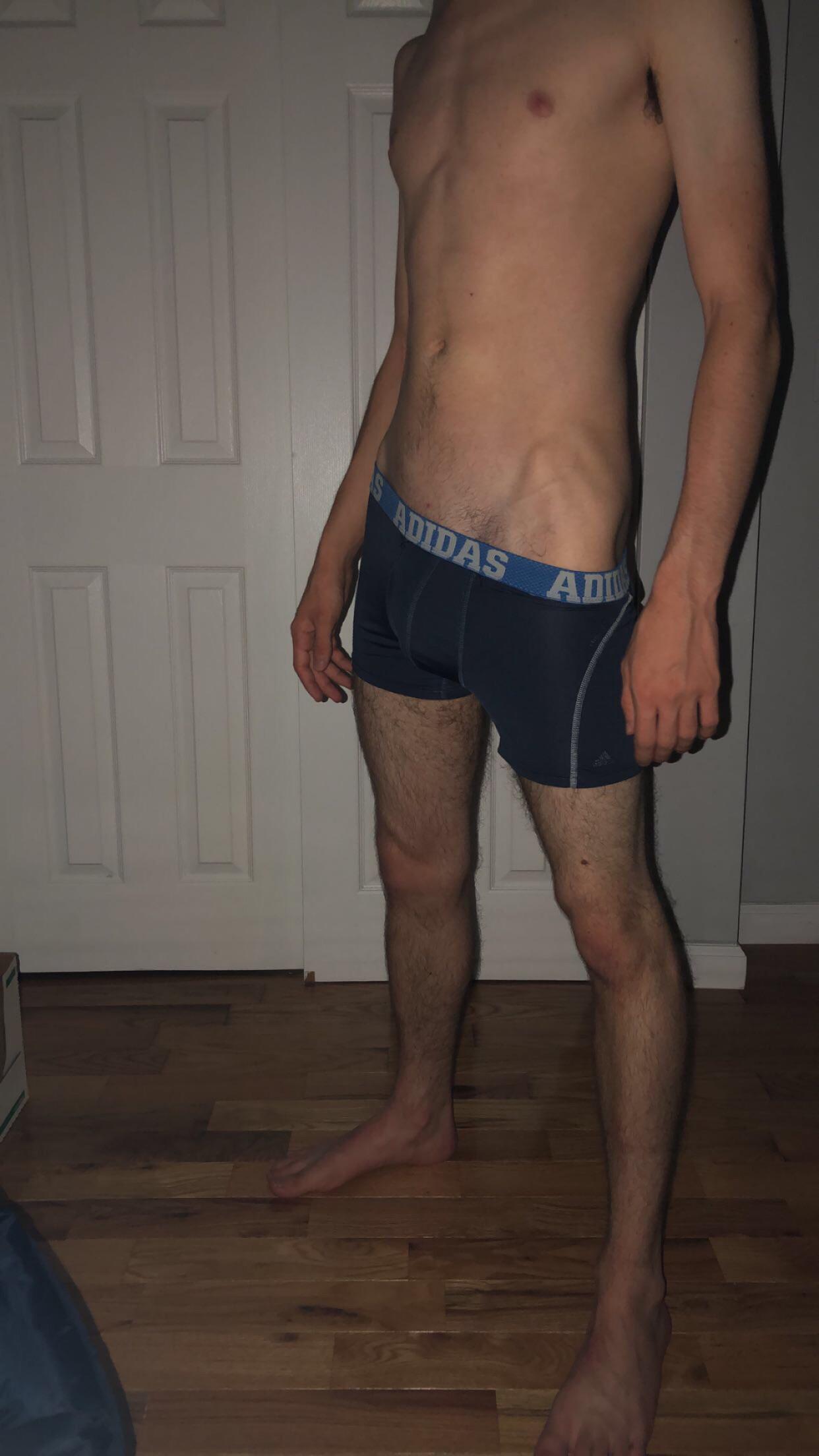 Should I pull them down? | Scrolller