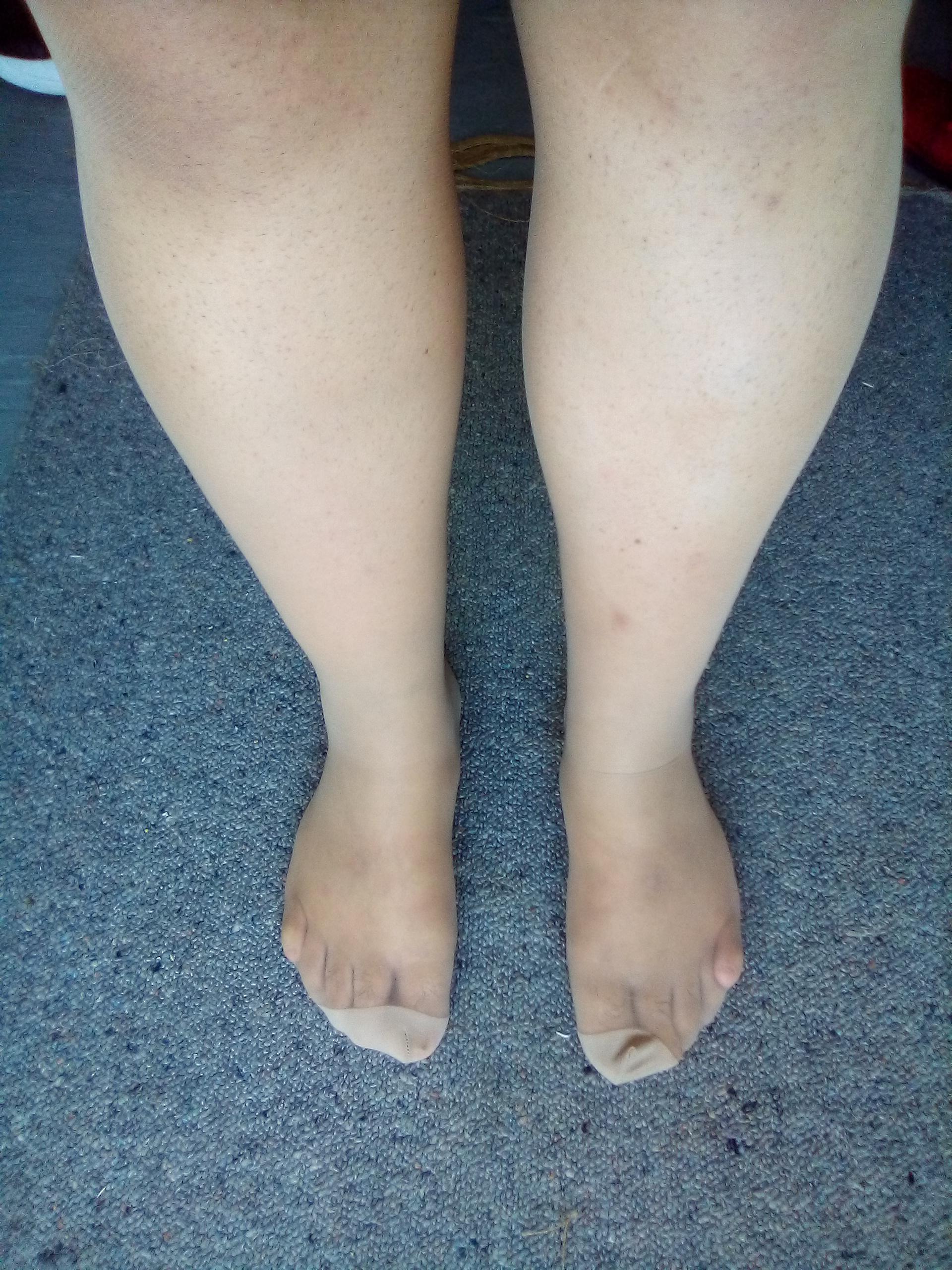 Silky legs. | Scrolller