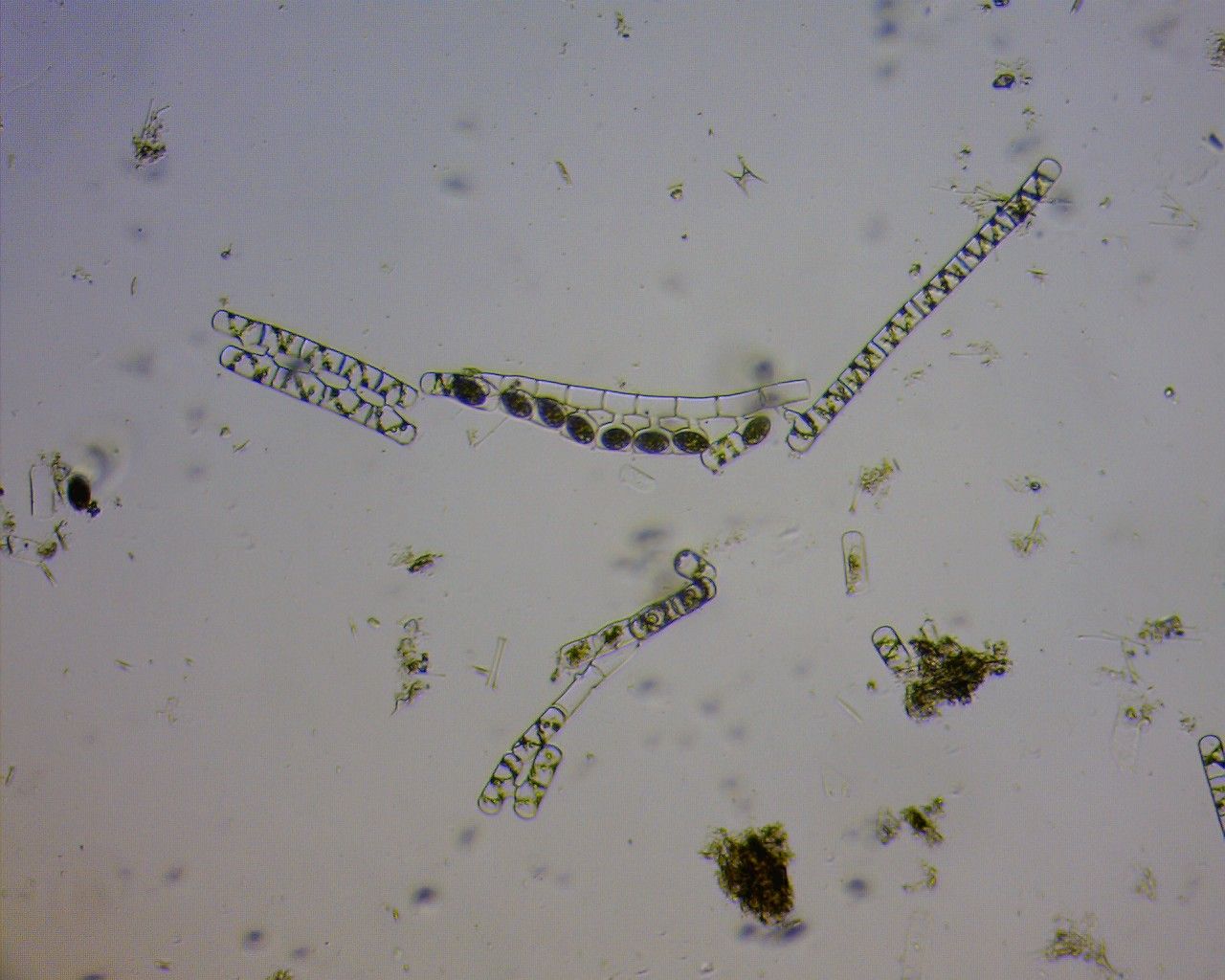 Spirogyra algae in various stages of conjugation | Scrolller