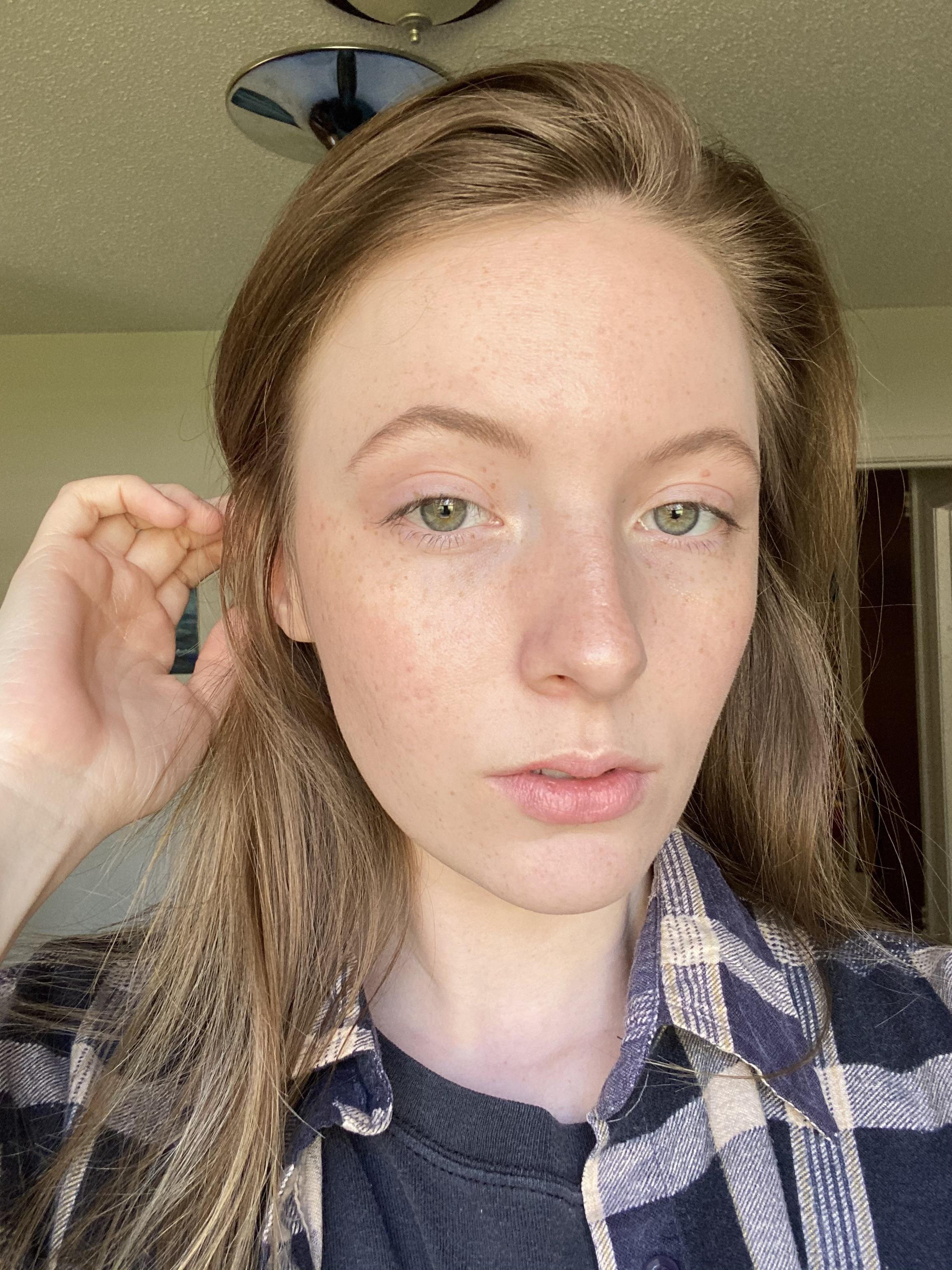 Springtime brings on the freckles 🌼 | Scrolller