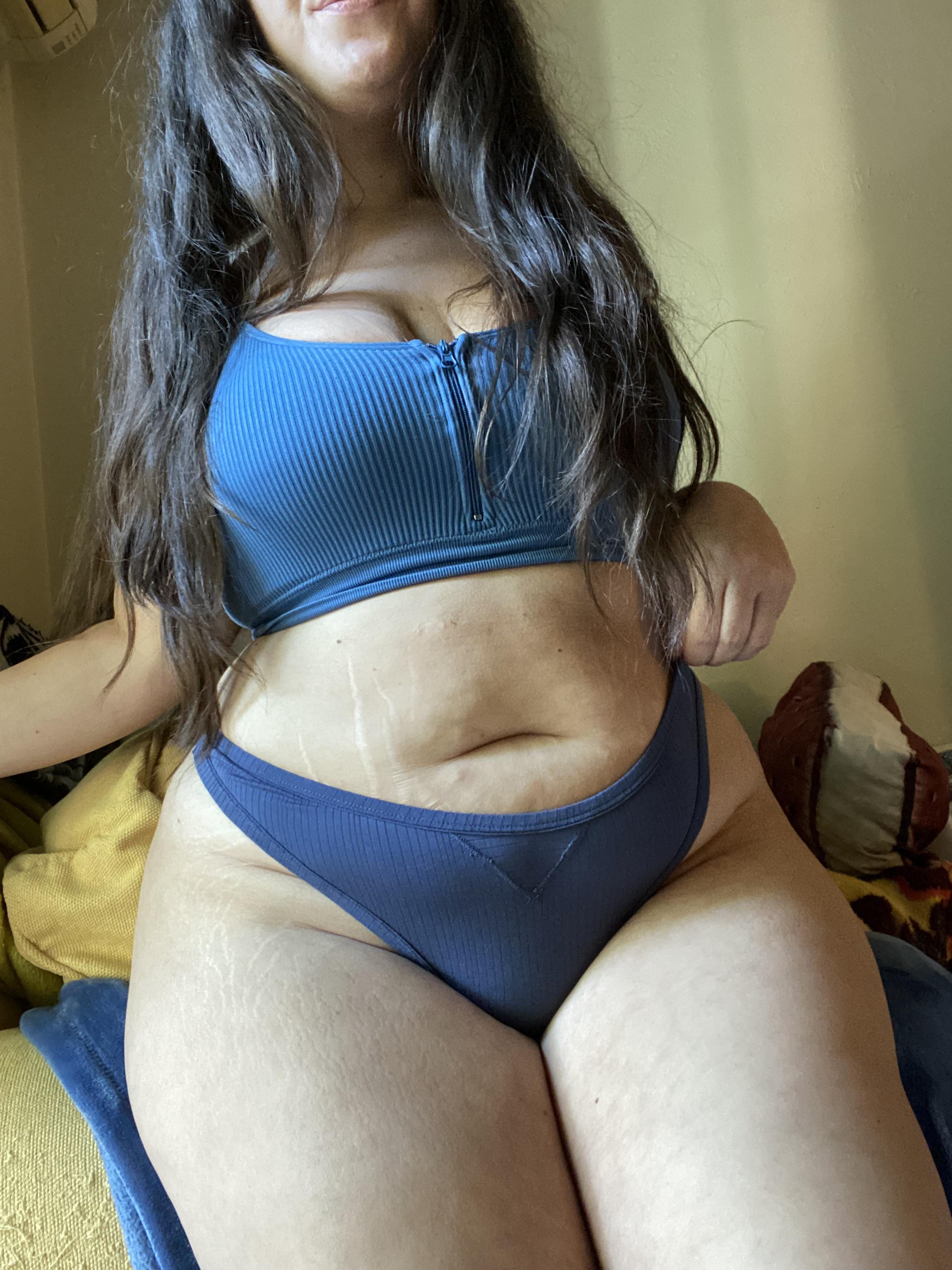 stretch marks like highways 😊 | Scrolller