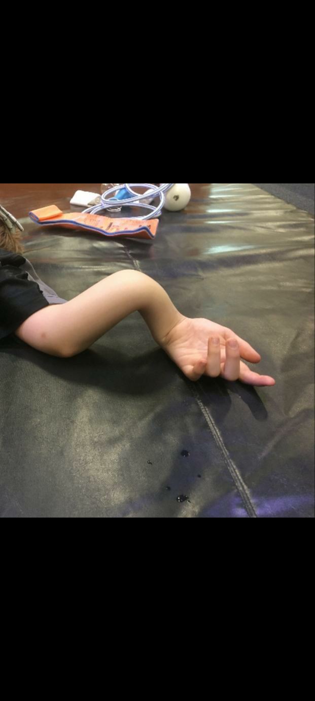 Student broke his arm during gym class | Scrolller