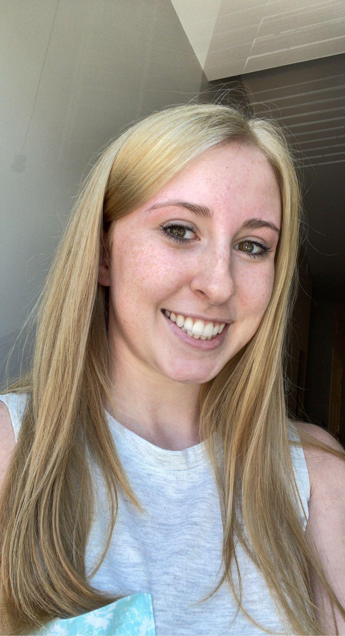 Summer Freckles 😌☀️ Scrolller