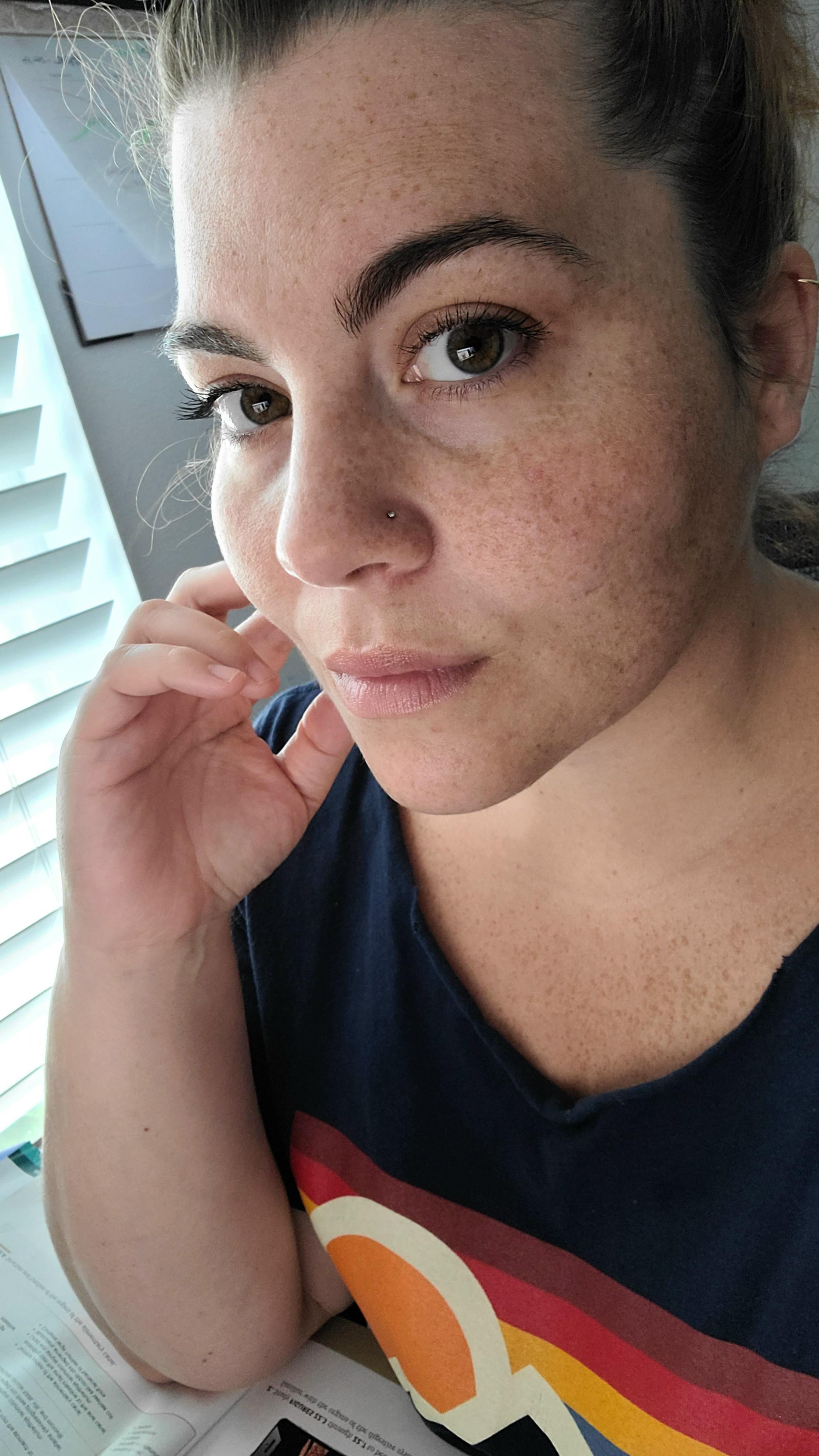 Sun out freckles out | Scrolller