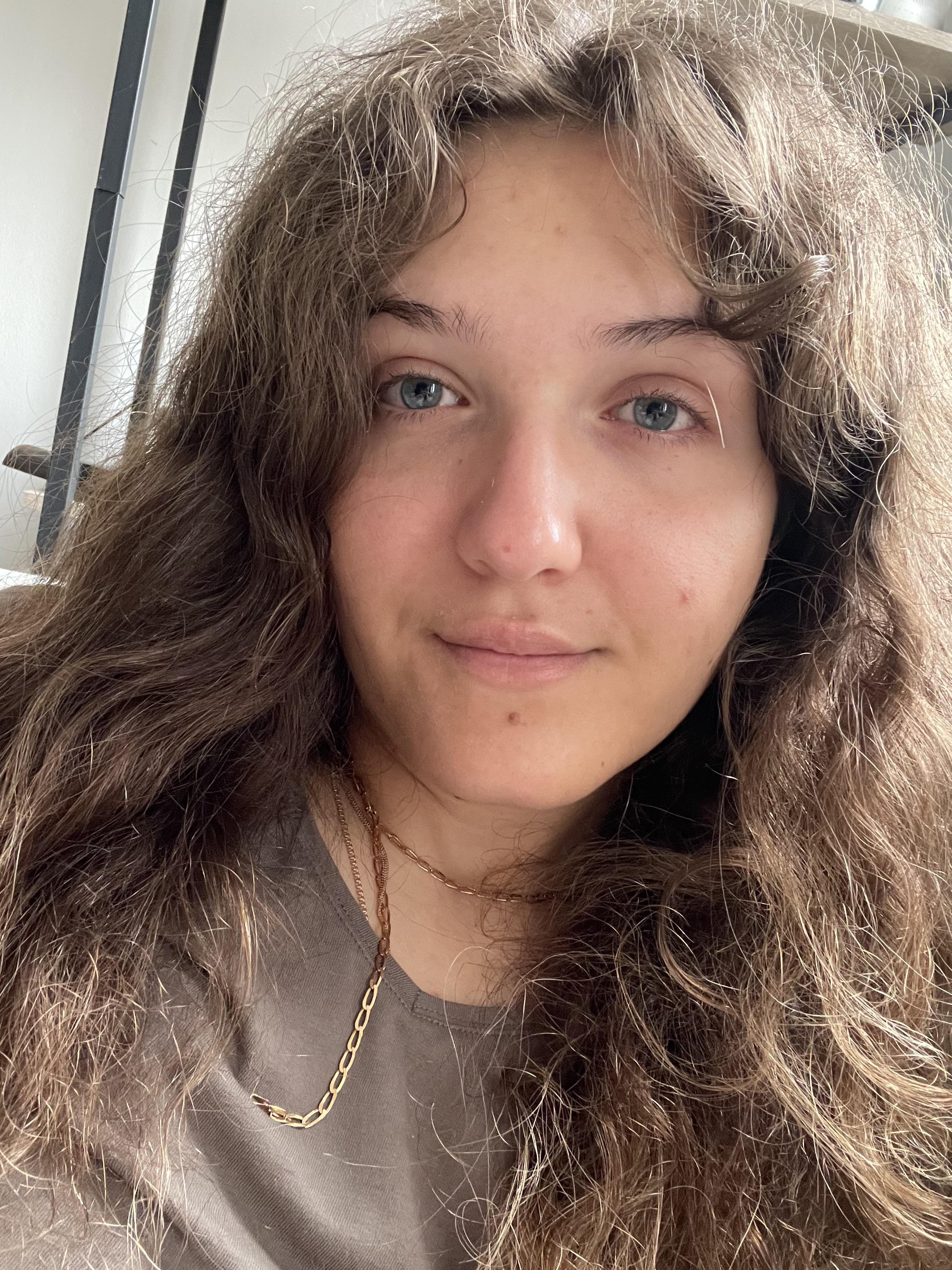 sunburnt sleepy selfie ☀️ [21f] | Scrolller