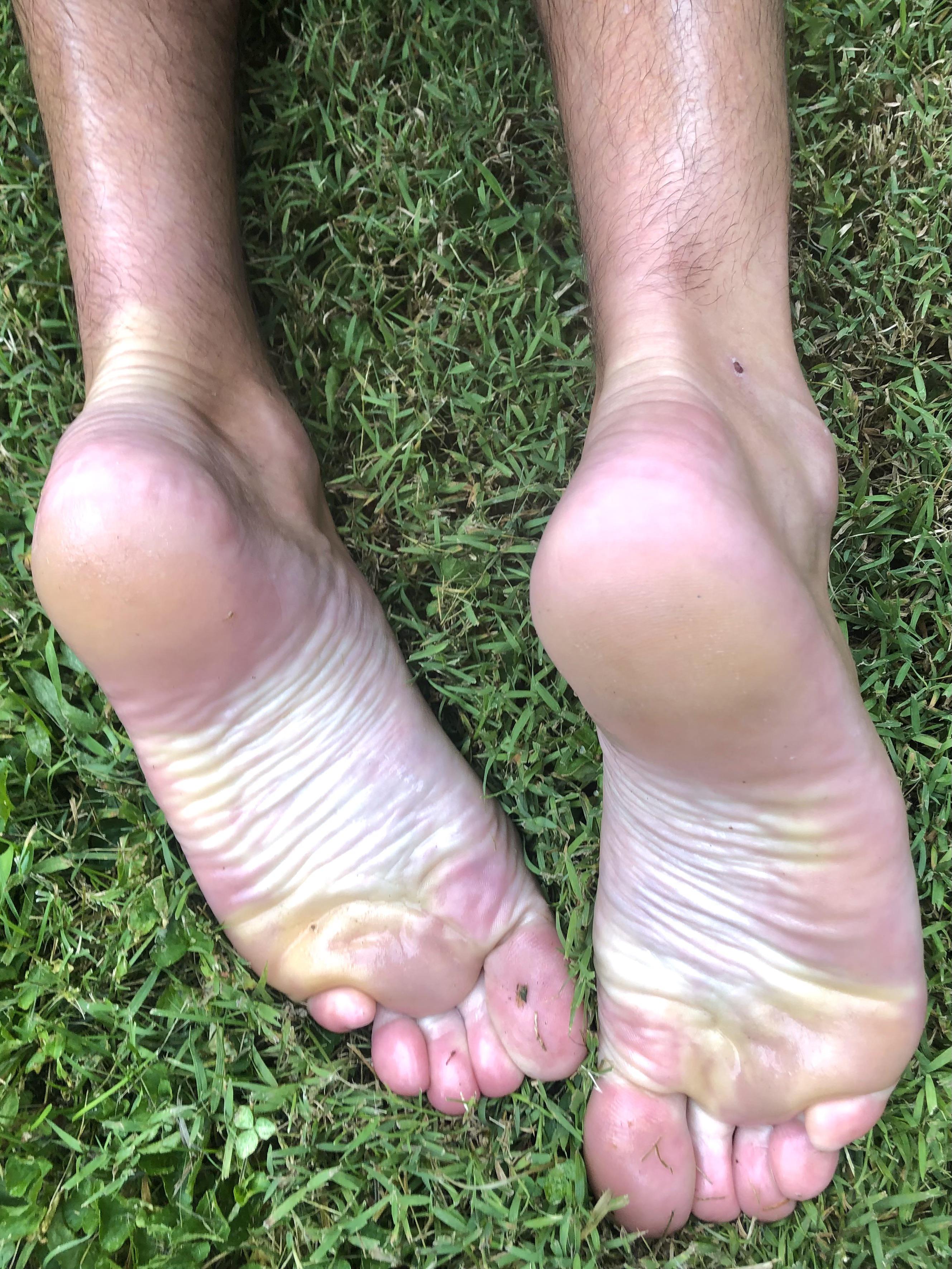 Sweet summertime feet! | Scrolller