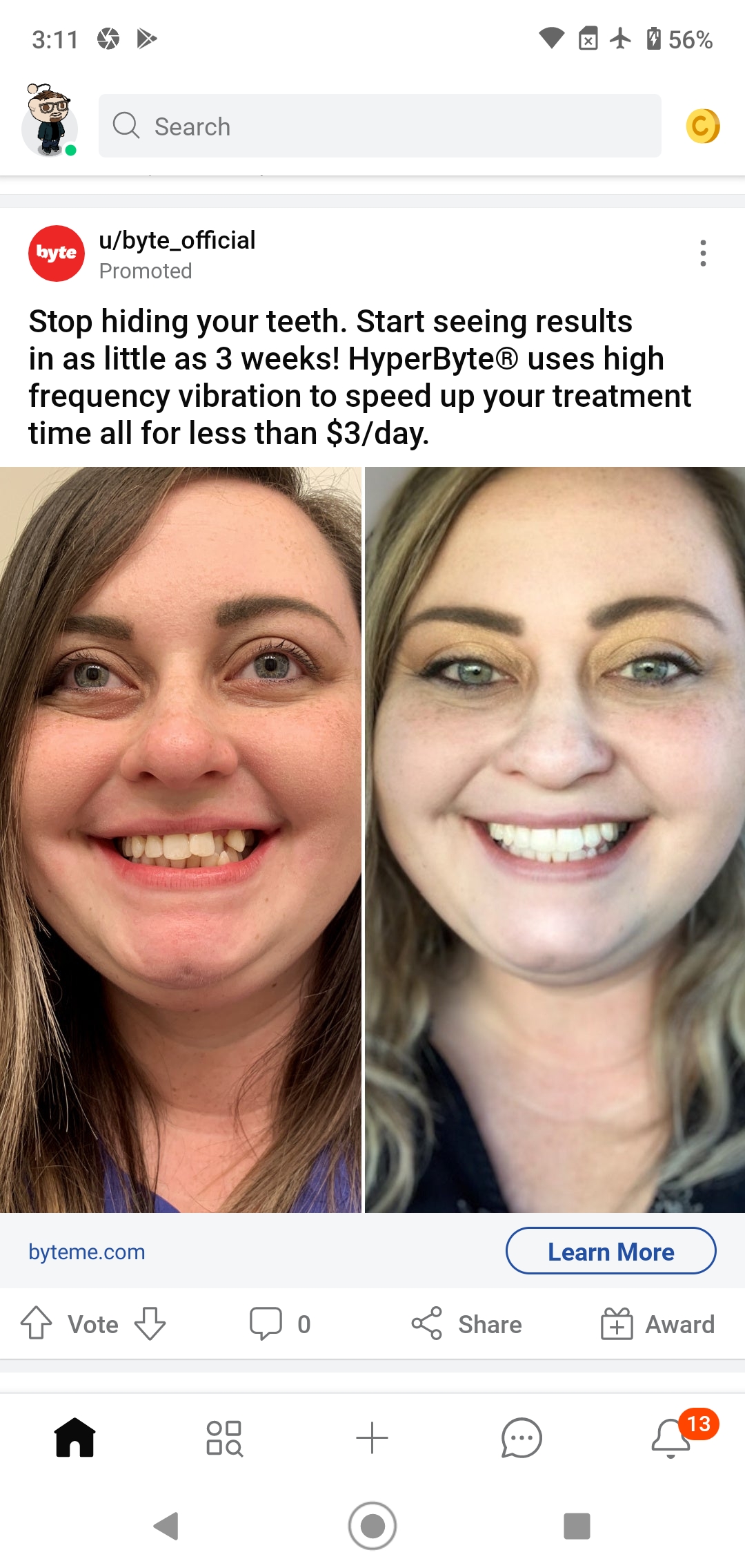 Teeth so bright it even straightened her eyes! | Scrolller