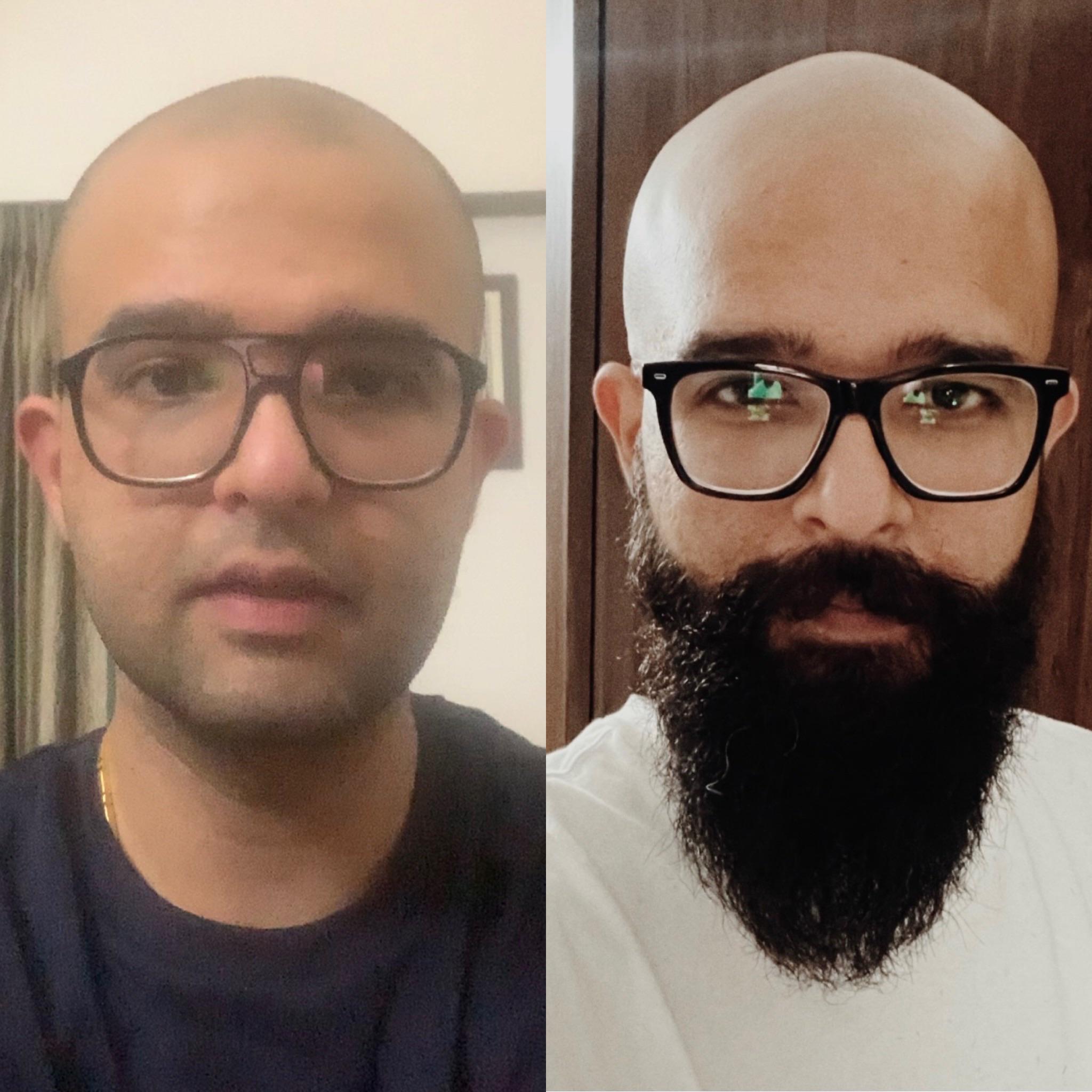 The beard made quite a difference… | Scrolller