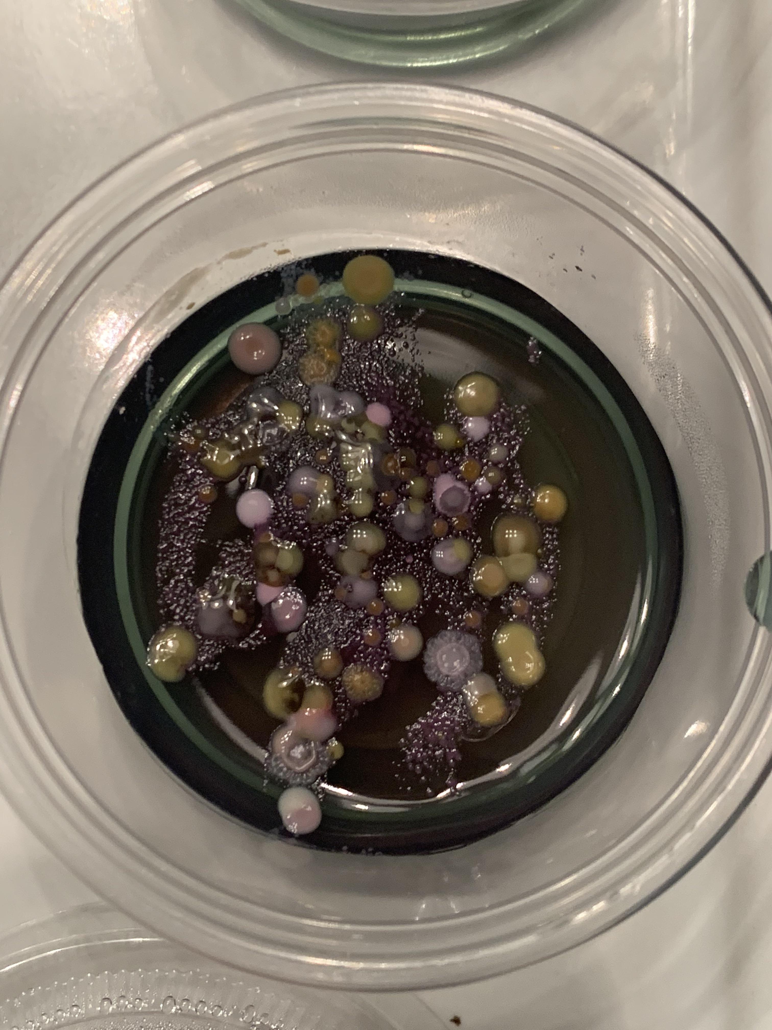 The beauty of my belly button bacteria | Scrolller