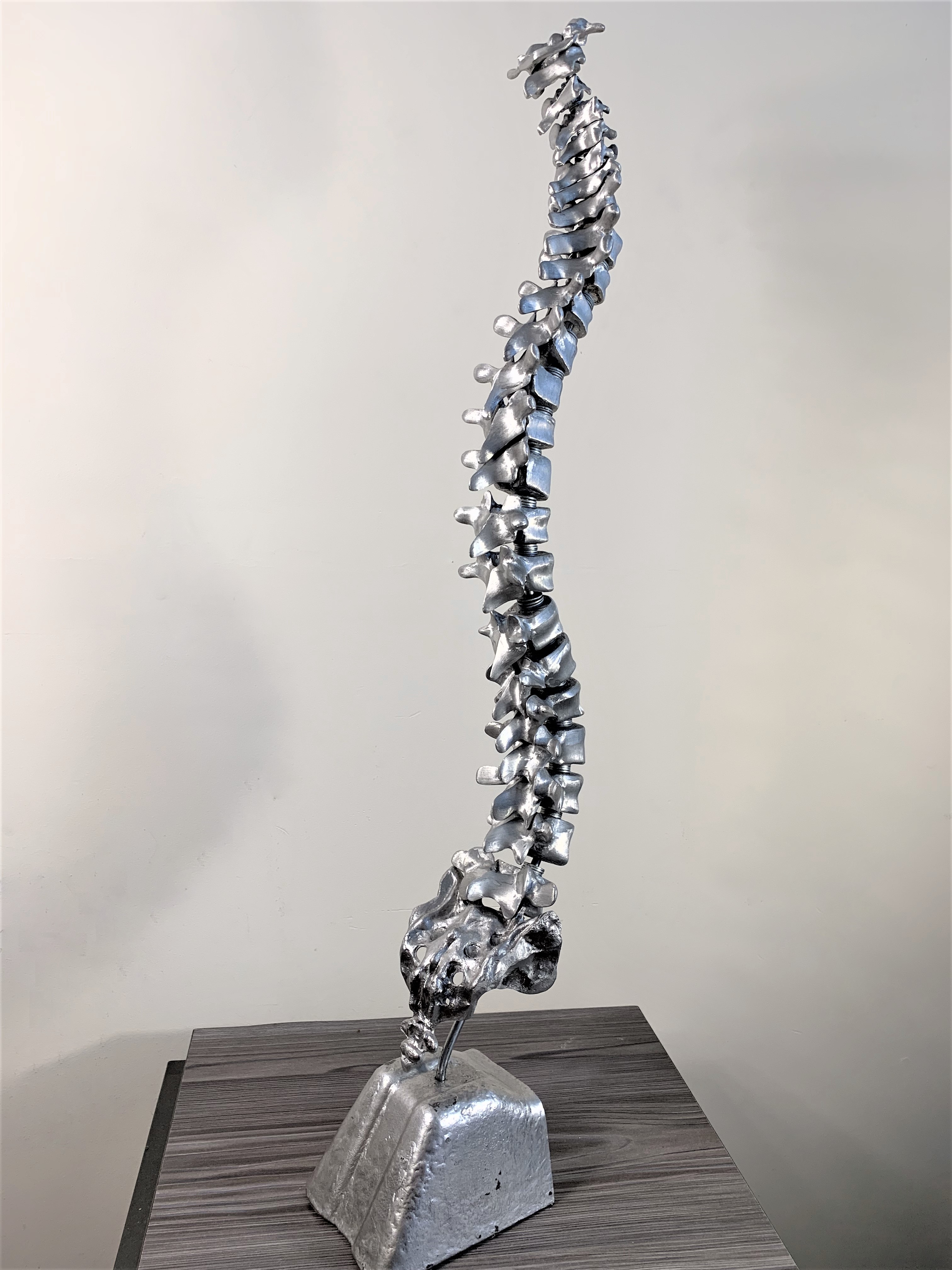 The Human Spinal Column - Aluminium | Scrolller