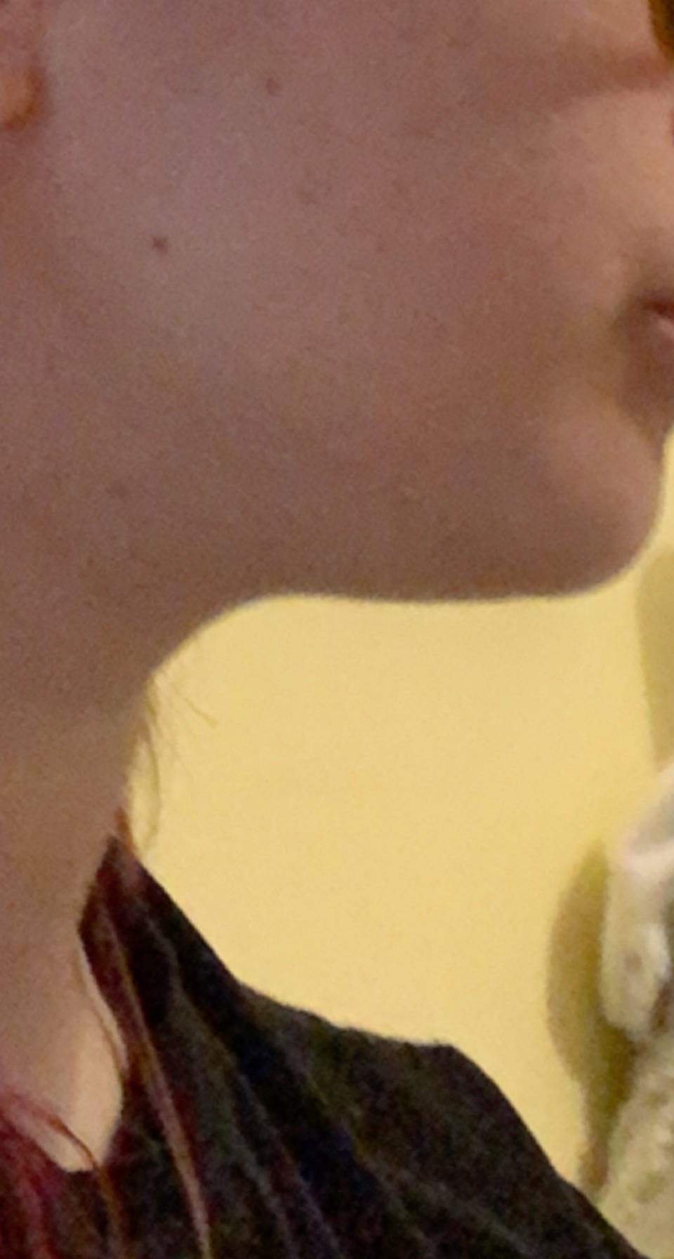 this is what happens when i *try* to mew. any tips?? | Scrolller