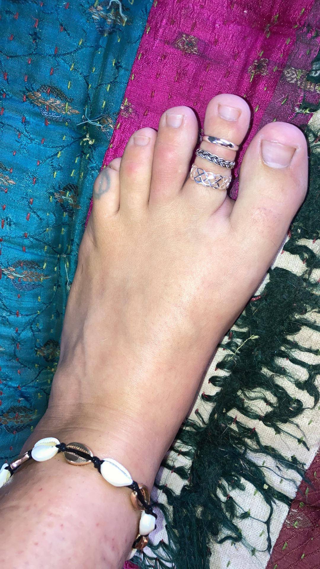 Three rings on one toe :) | Scrolller