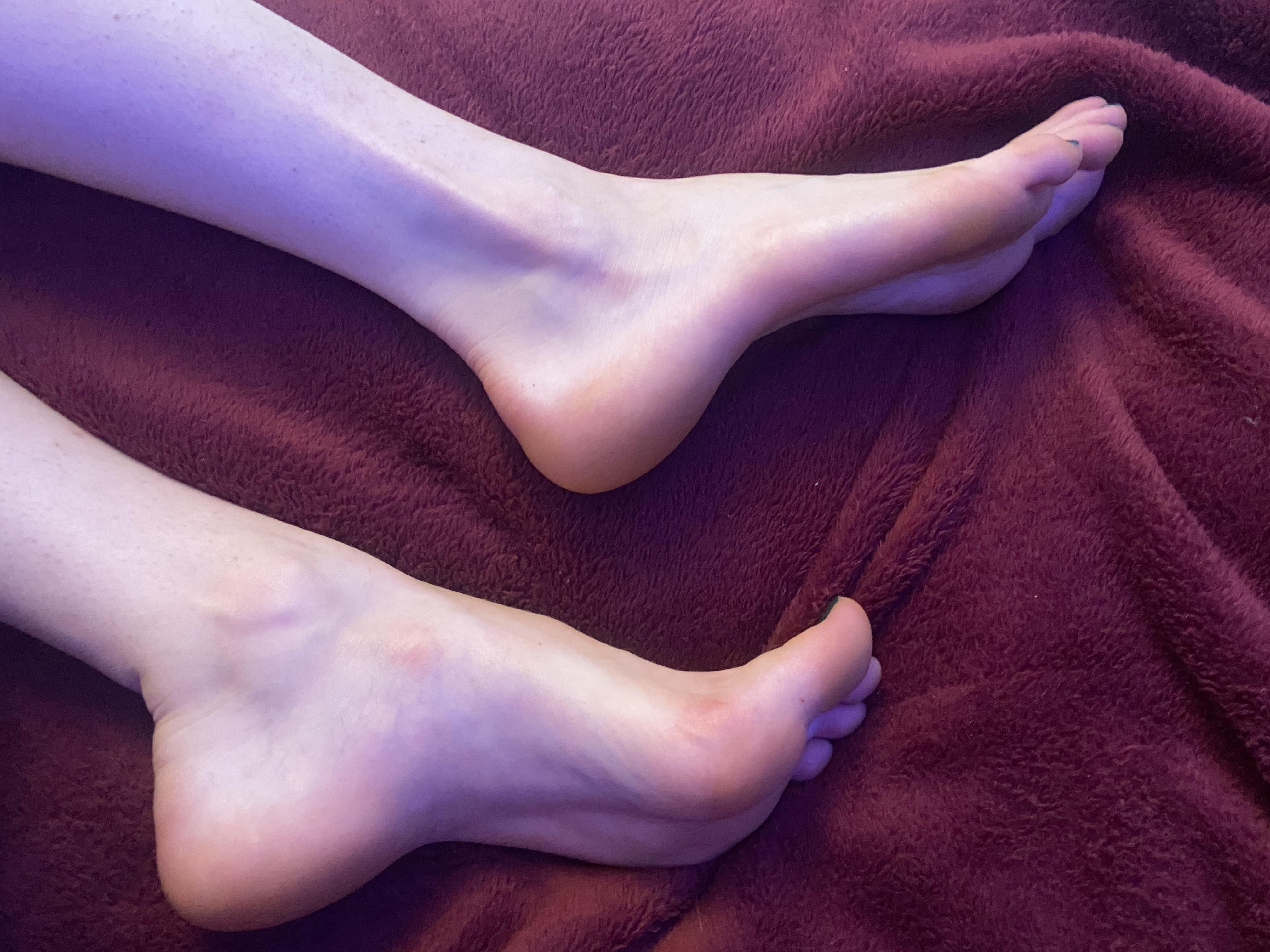 Tickle me ! | Scrolller