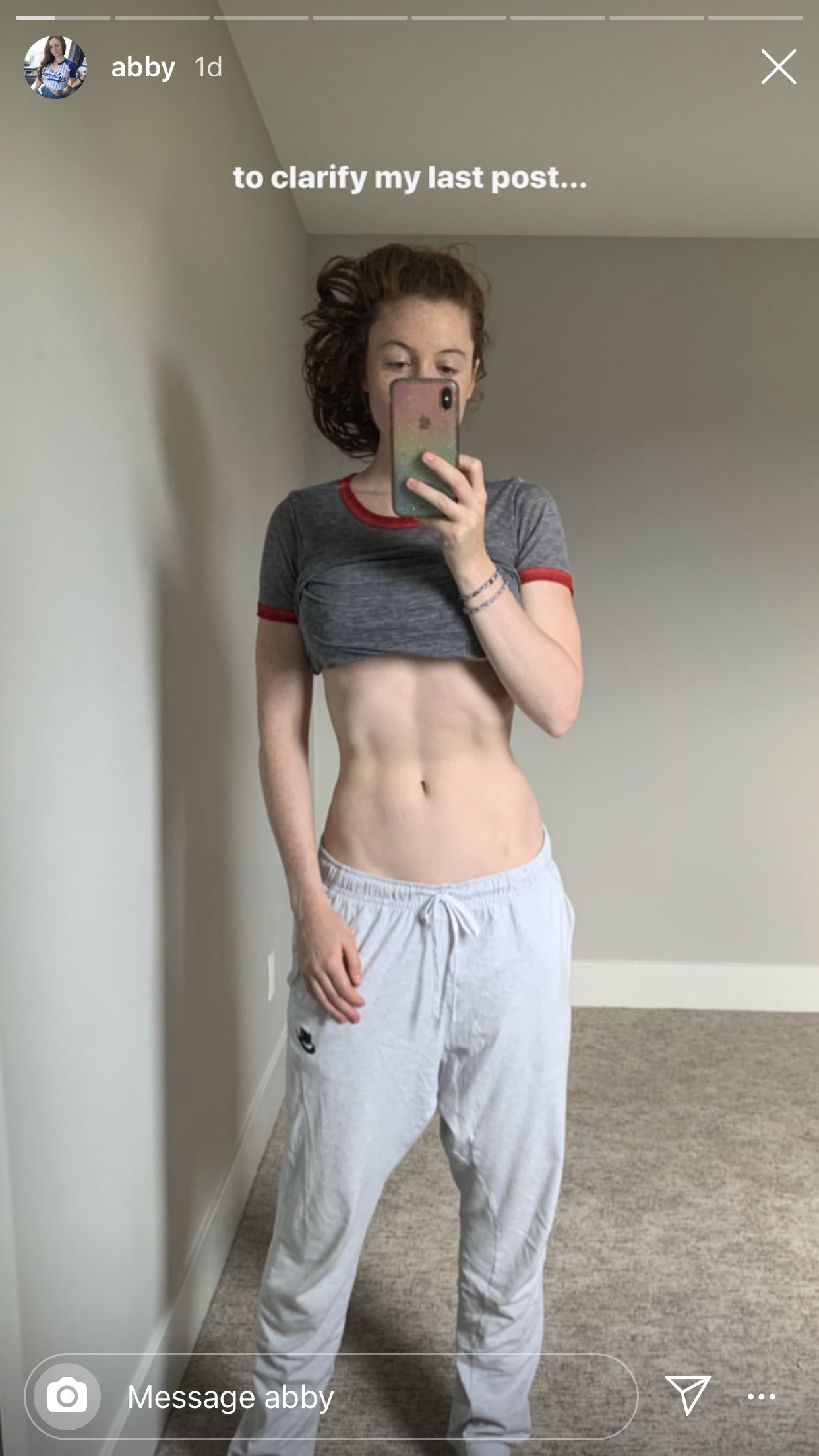 Tight tummy | Scrolller