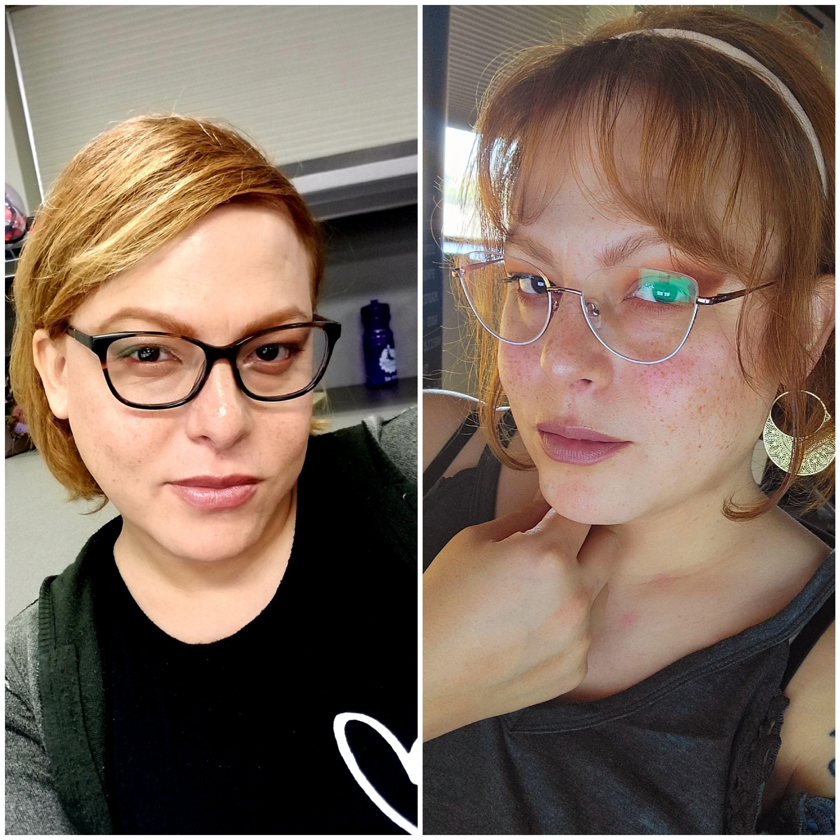 Hello! I'm 42 years old, with 4 years of hrt. First pic is from around the beginning of hrt ...