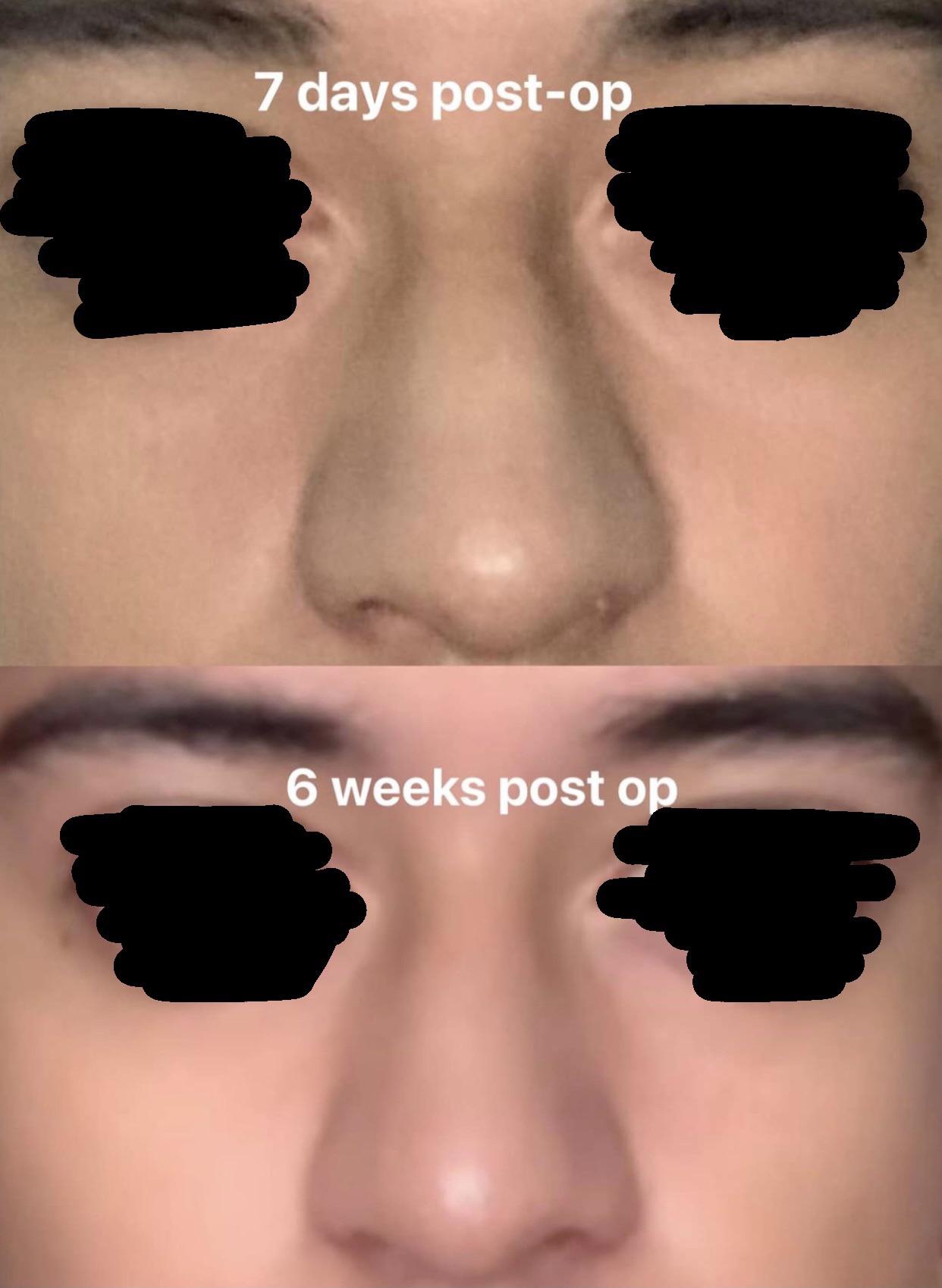 Trust the process! | Scrolller