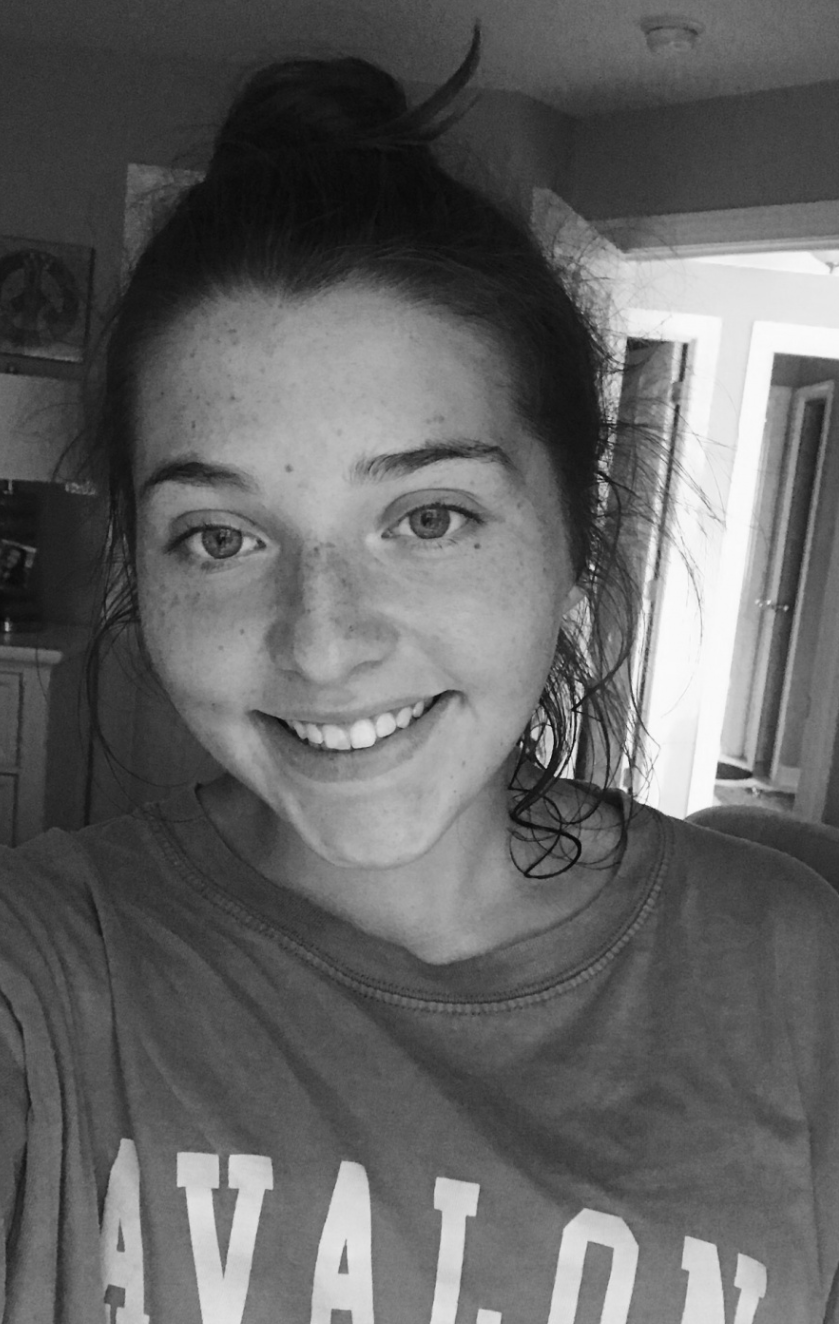 Two extra-large and extremely attractive freckles. (xpost r/FreckledGirls) | Scrolller