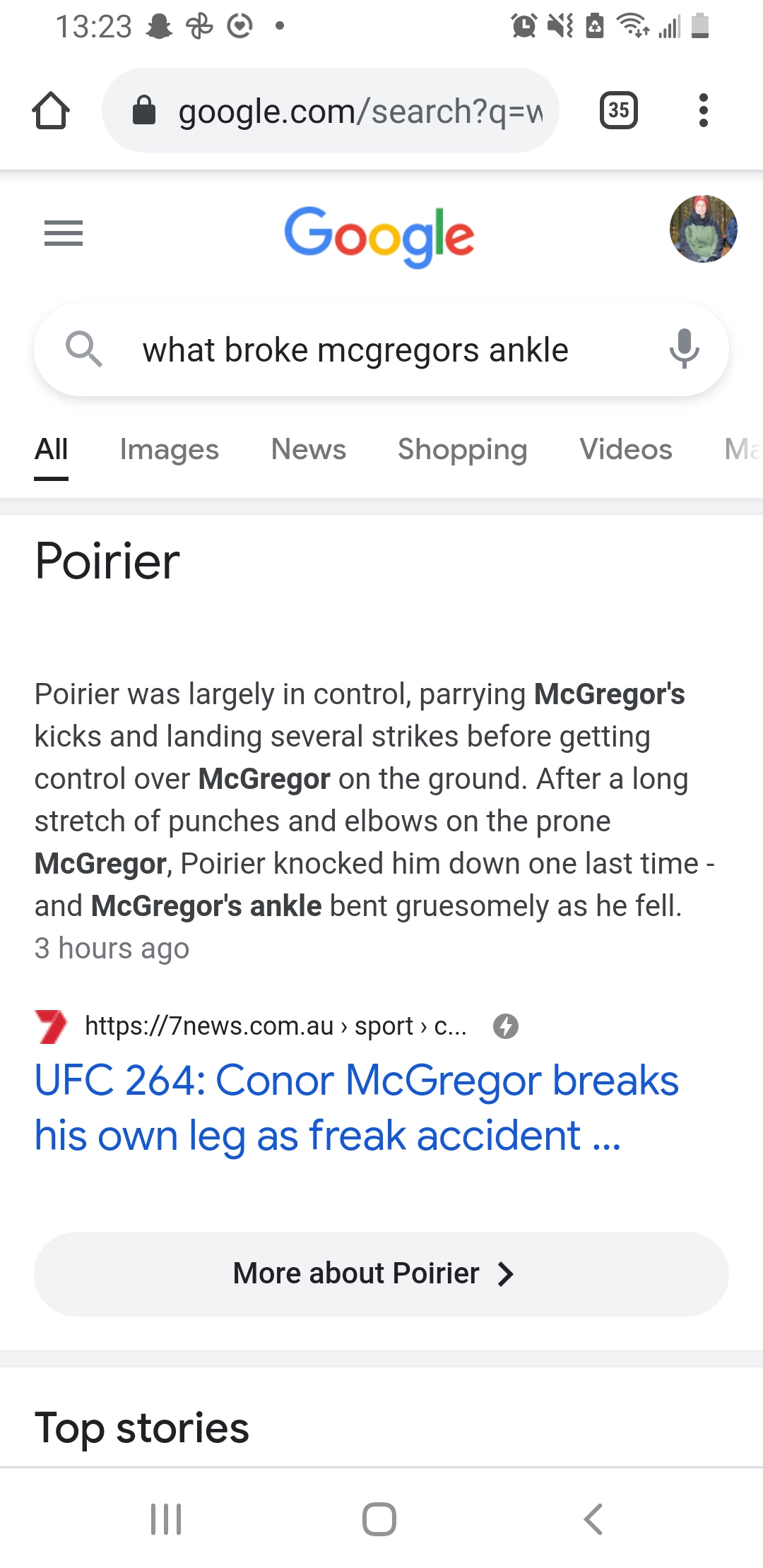 Was trying to look up what broke Wankles McGregor's leg and this was what showed up in google ...