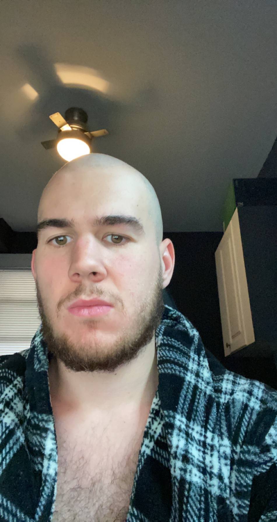 Went for a walk but wore a hat today. When will I not care what people think? This is day #1 of ...