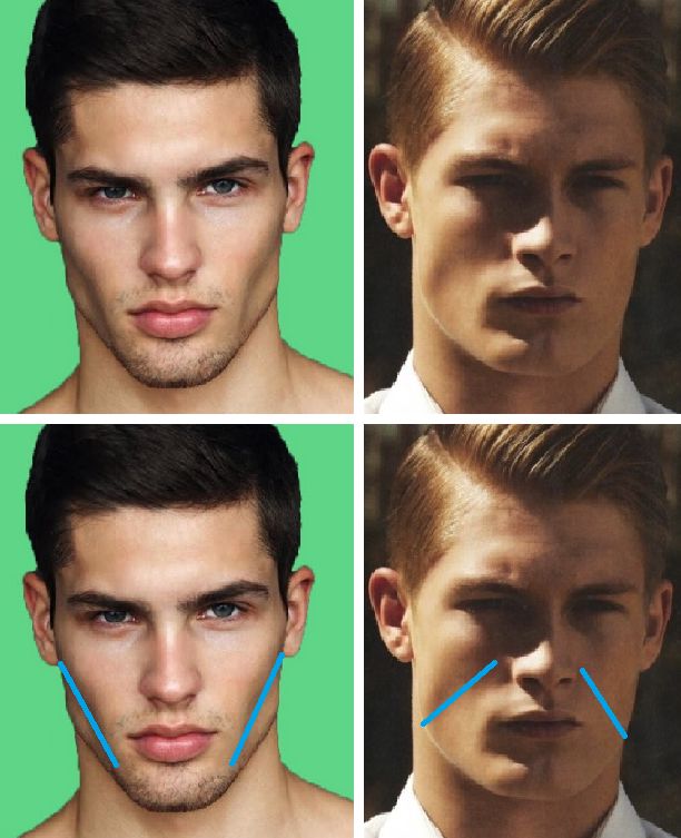 What causes the difference between these two types of hollow cheeks? It's not the lighting btw ...