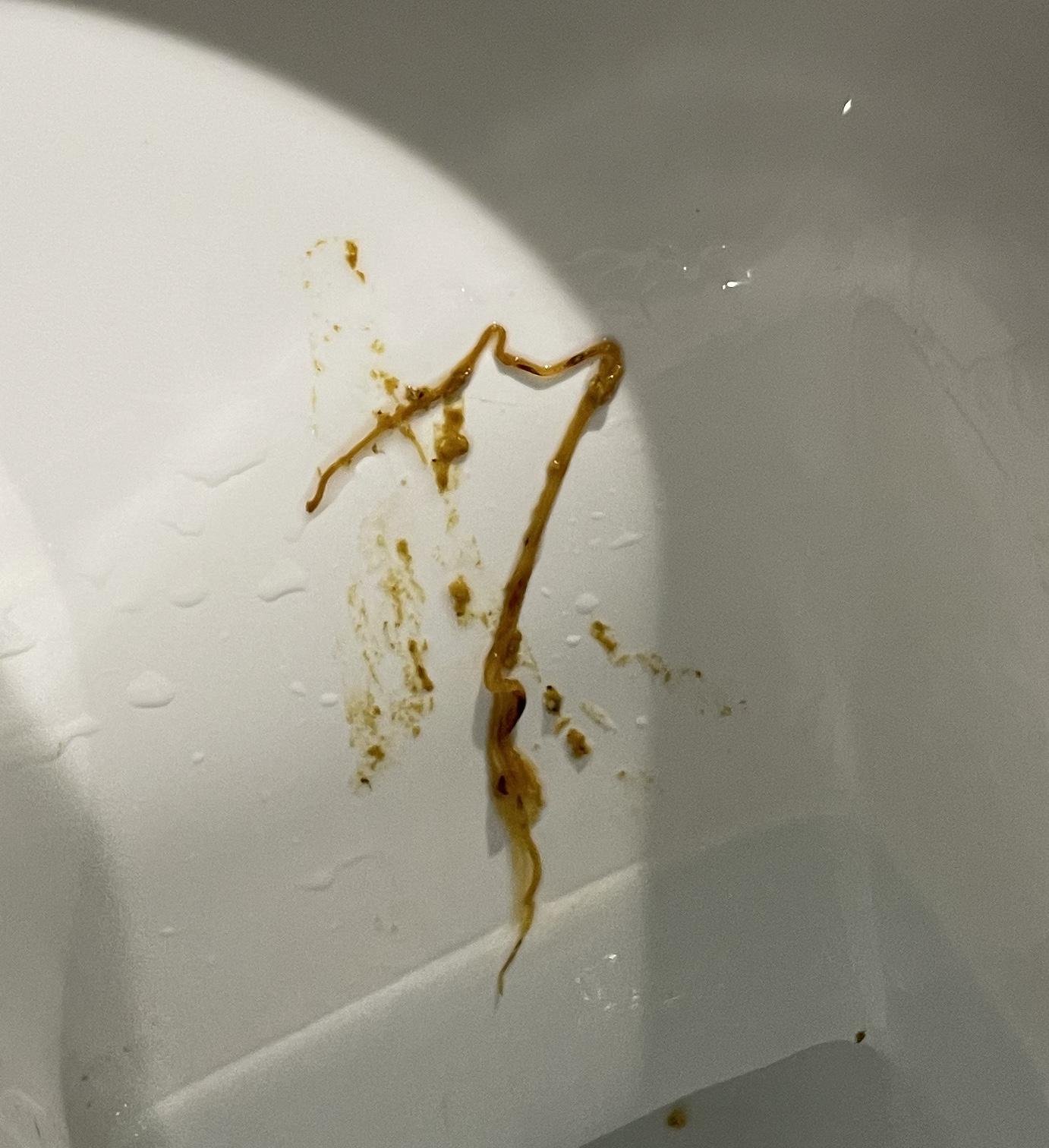 What did I just poop?? | Scrolller