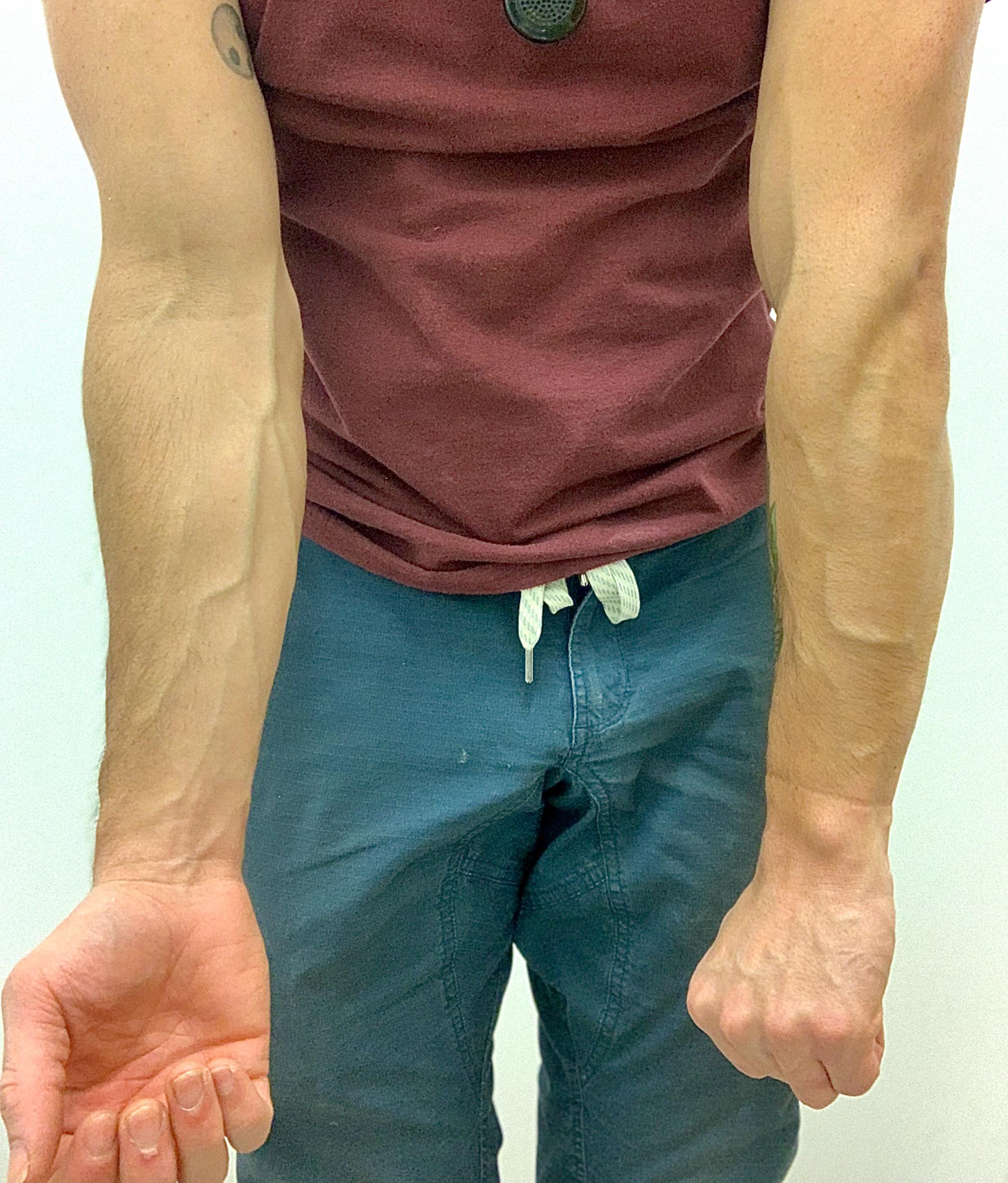 What do you think of my rock climber forearms? | Scrolller