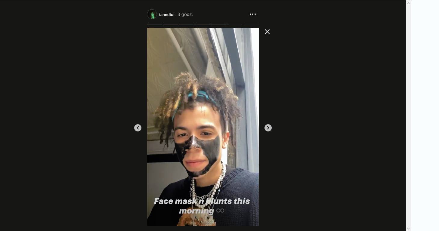 What is this on Iann's forehead? He's had this for like a week now, looks like some sort of scar ...