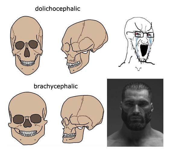 What's your skull shape? | Scrolller