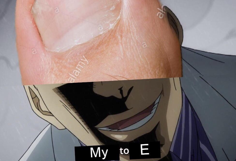 When you stub your toe: | Scrolller