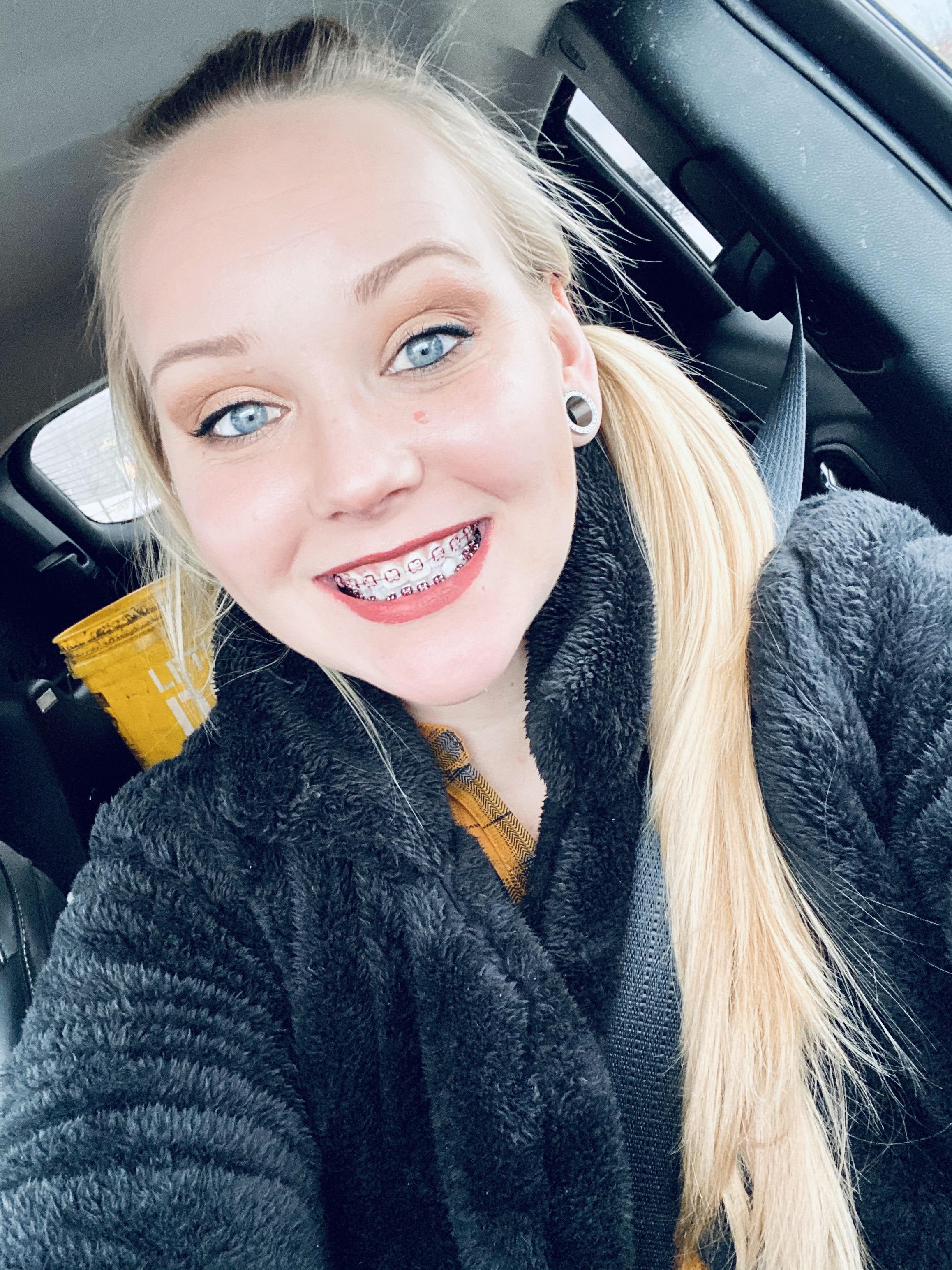 Wide smiles with allllll the brackets | Scrolller