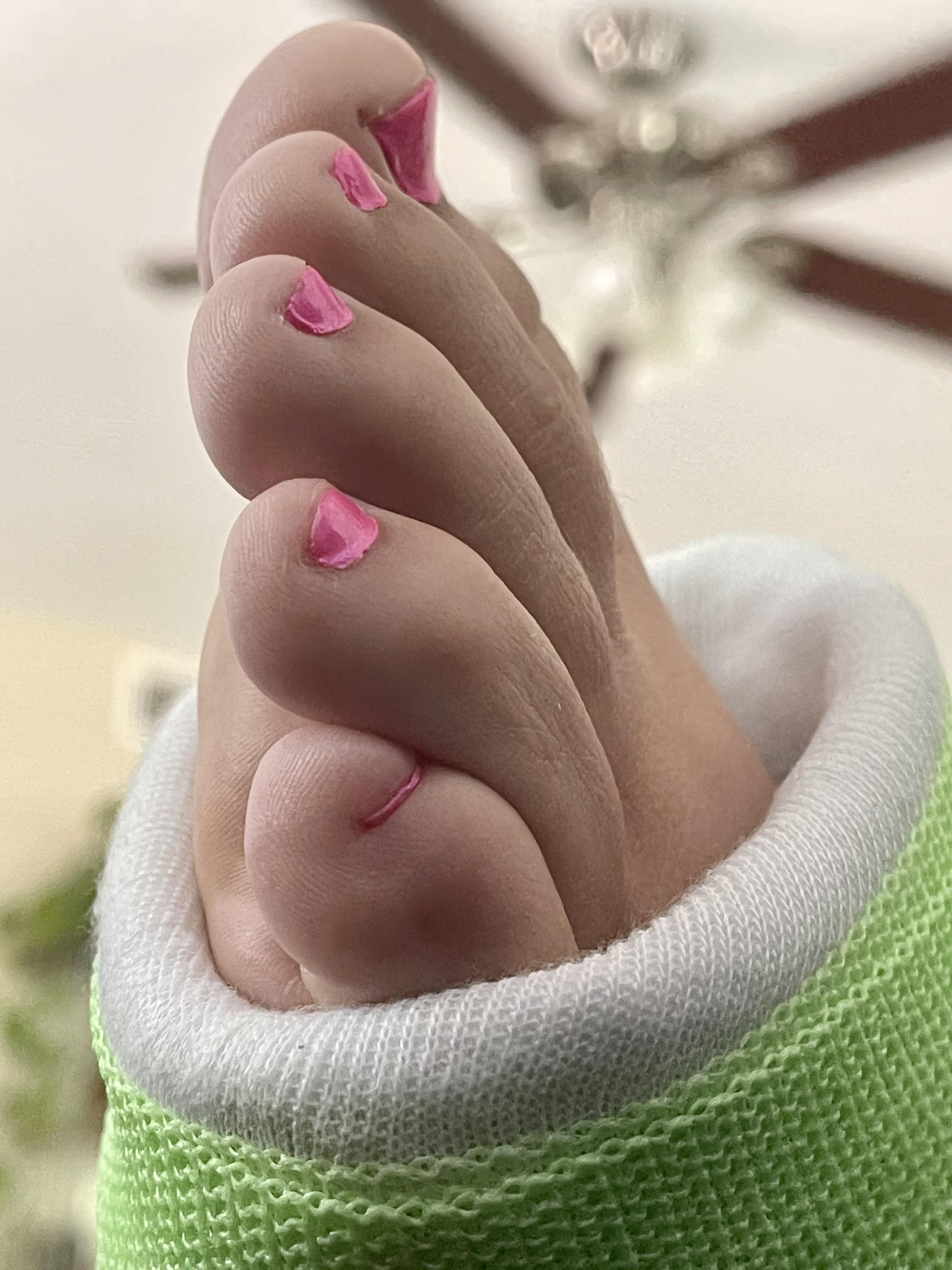 Wife broke her ankle, but her toes are still very much in play. | Scrolller