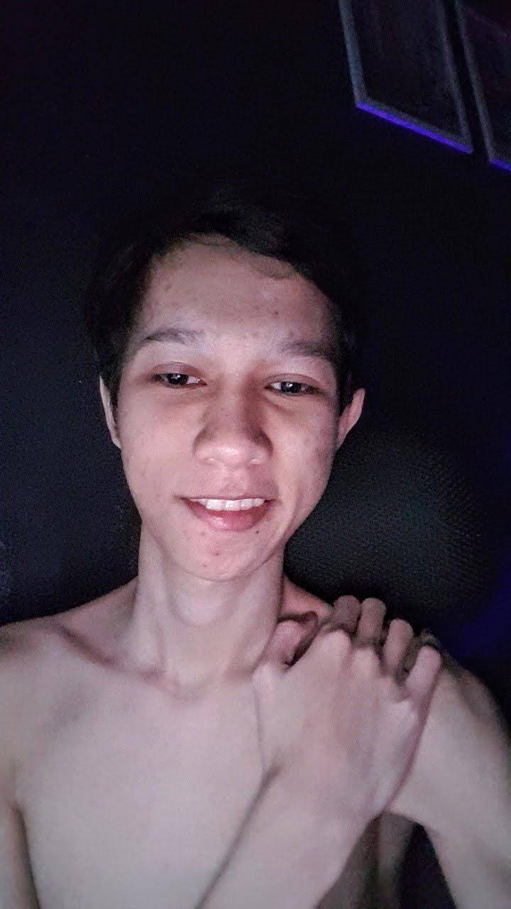 19yo hairless boy here | Scrolller