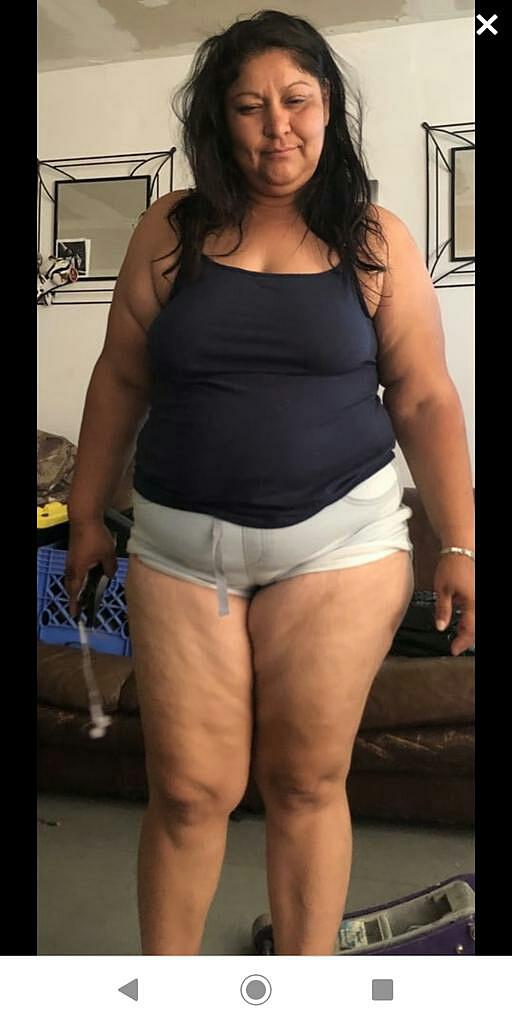 Woman Standing In Her Living Room Has Cellulite On Her Thighs | Scrolller