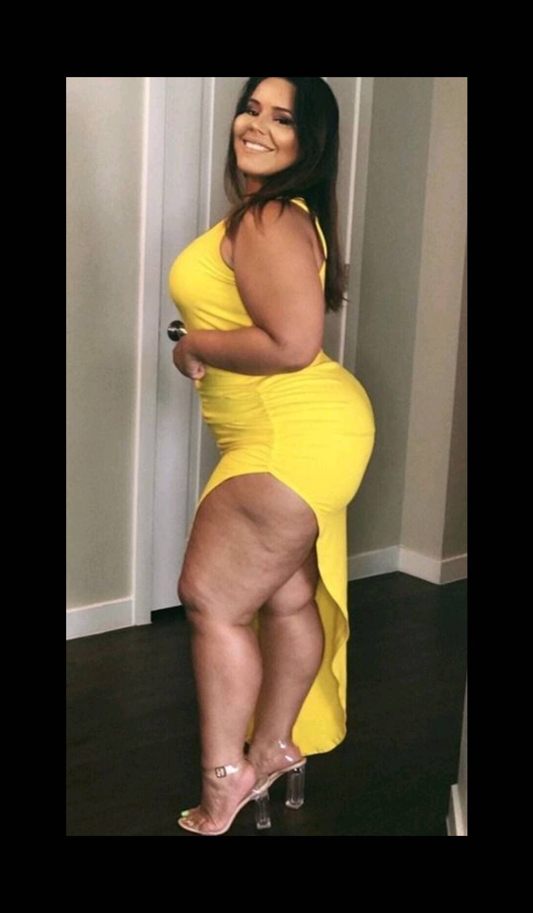 Woman Wearing A Yellow Dress Has Cellulite On The Side Of Her Thighs | Scrolller