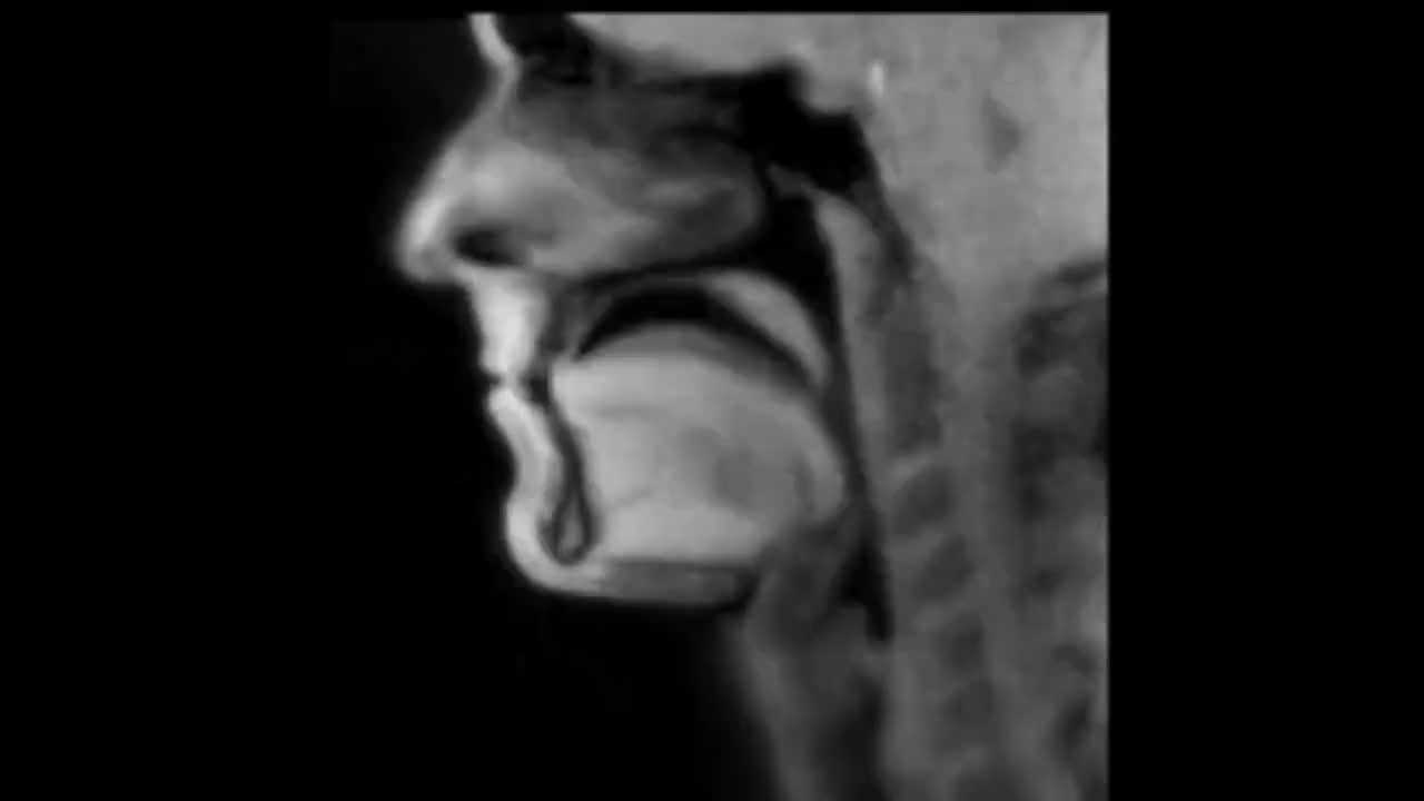 Beatboxing from the perspective of an MRI | Scrolller